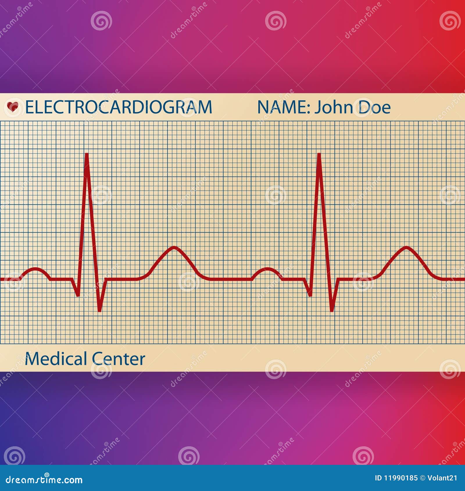 Documento Dell'elettrocardiogramma Con ECG Normale Illustrazione ...