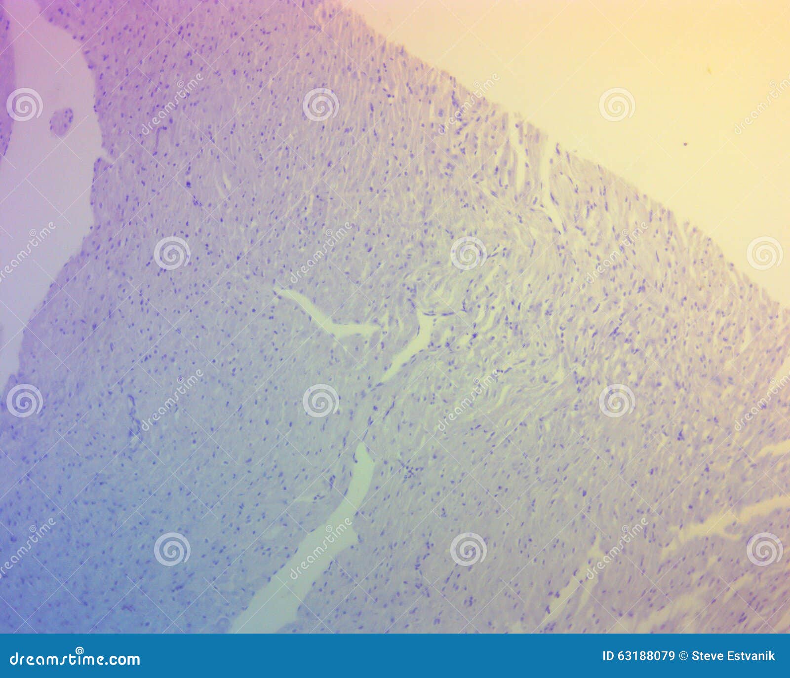 Dog cardiac muscle stock image. Image of anatomy, cell - 63188079