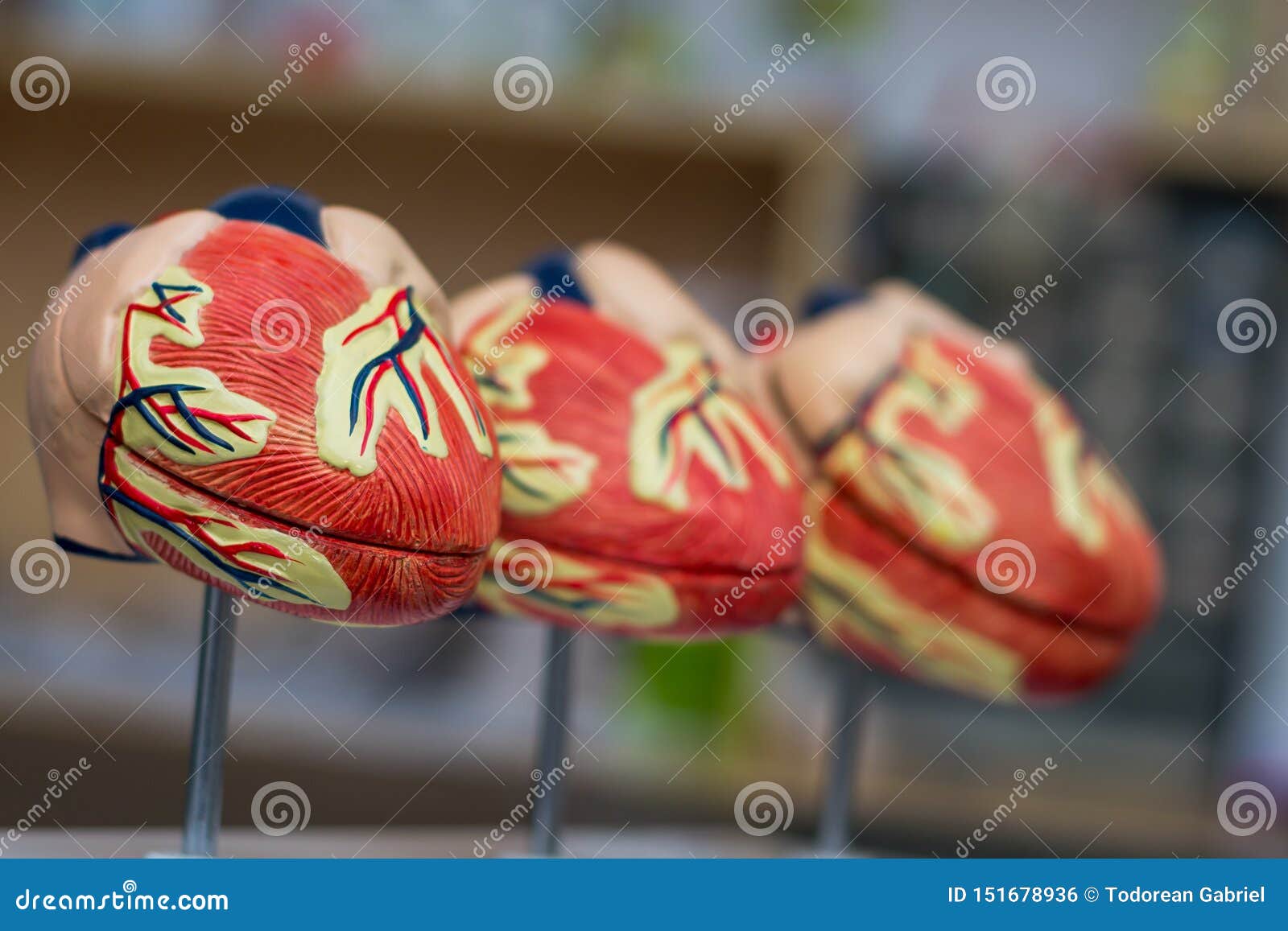 Normal Heart Function On Pulse Oximeter Pleth Graph Bar Stock ...