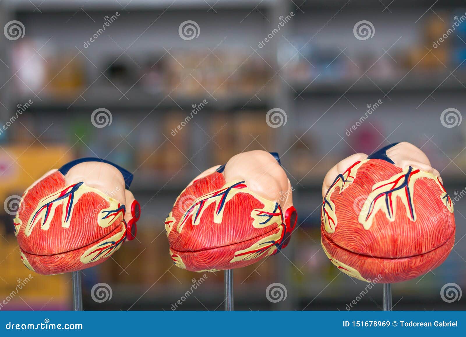 Normal Heart Function On Pulse Oximeter Pleth Graph Bar Stock ...