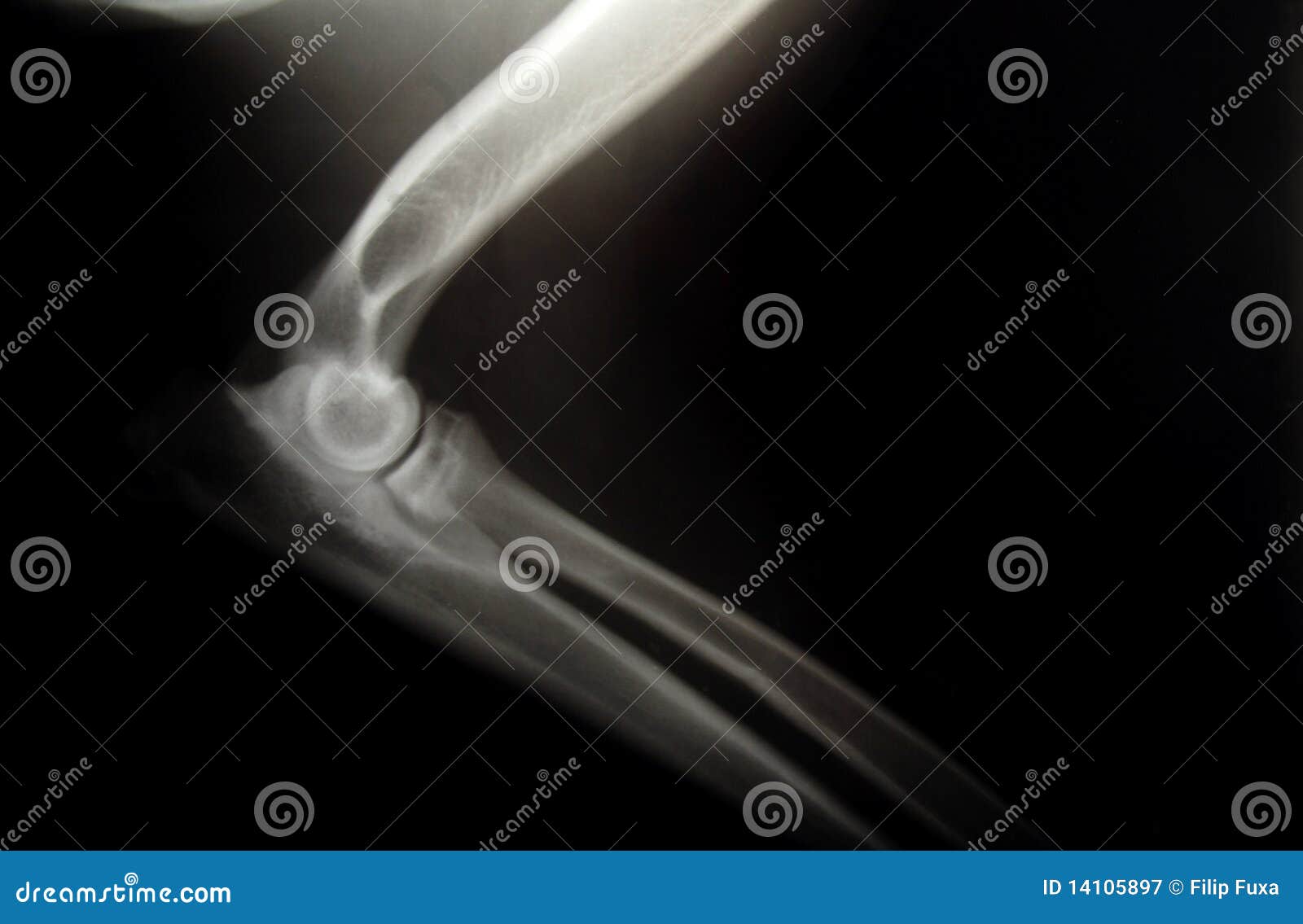 Dog x-ray stock image. Image of legs, labrador, treatment - 14105897