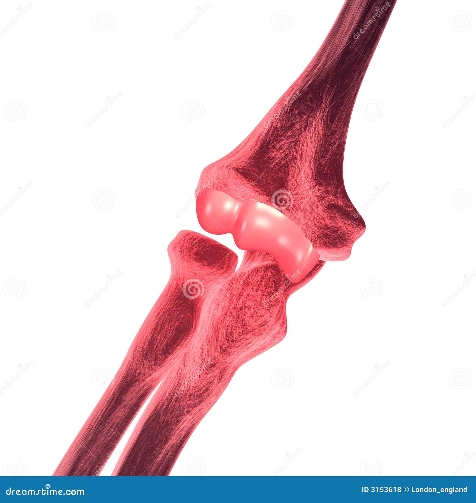 Dolor óseo del codo stock de ilustración. Ilustración de codo - 3153618