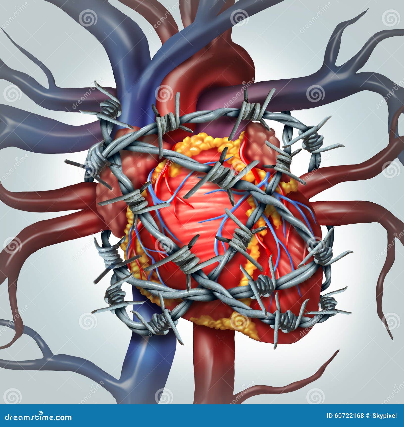 Dolor del corazón stock de ilustración. Ilustración de aorta - 60722168