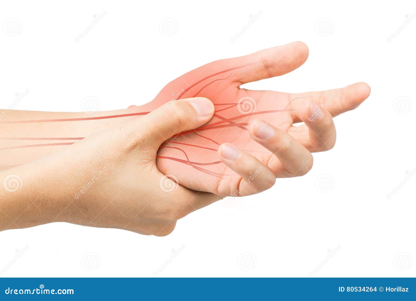 Dolor Del Nervio De La Mano Foto de archivo - Imagen de entumecimiento ...