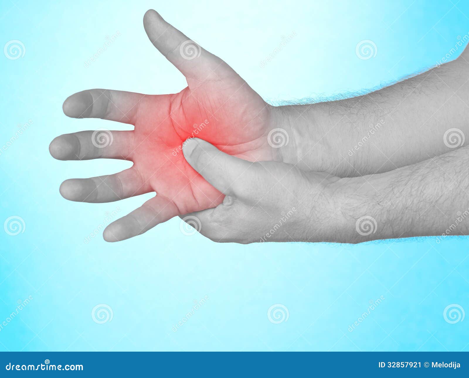 Dolore Acuto in Palma Della Mano. Immagine Stock - Immagine di corpo ...