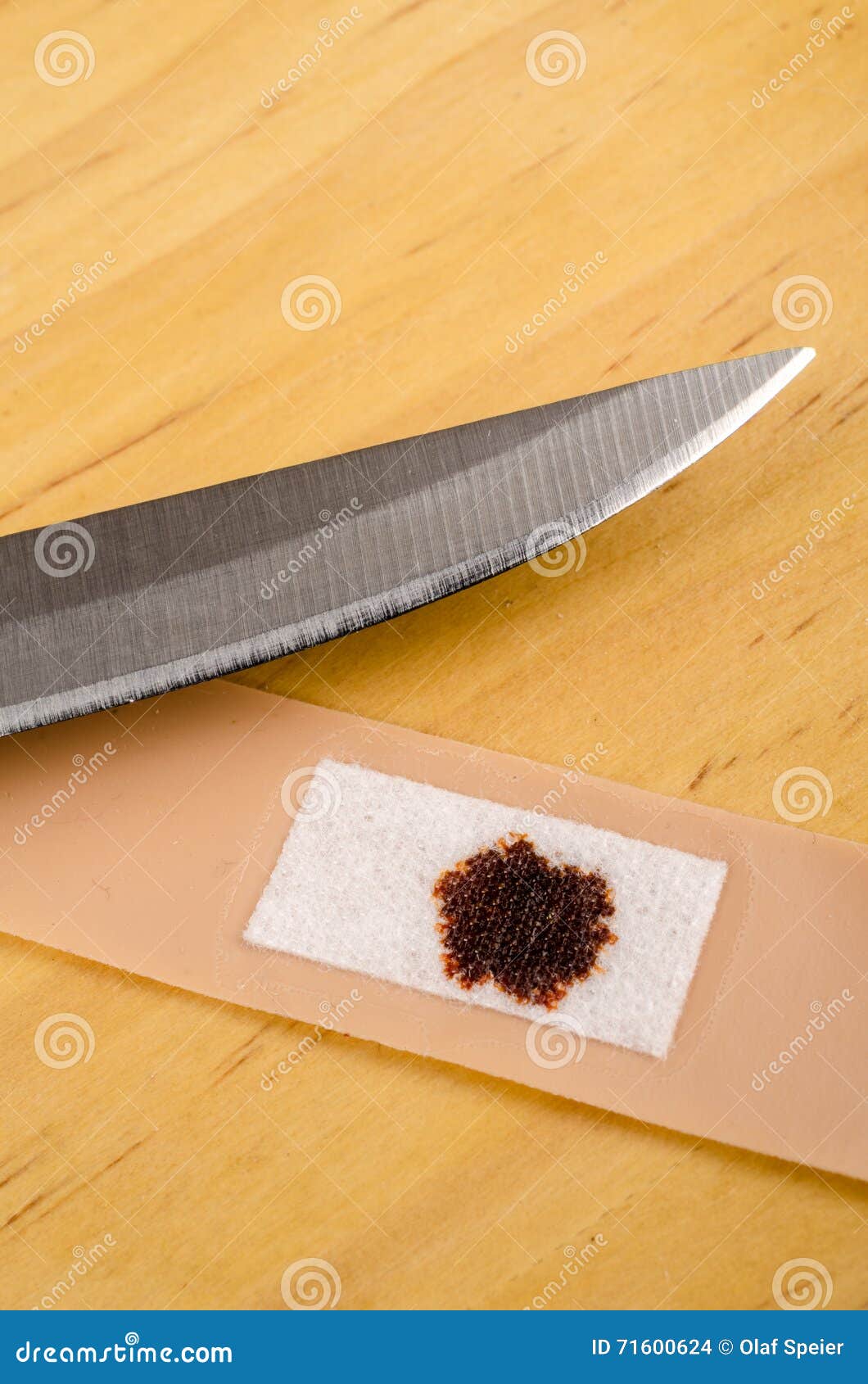 Domestic accident stock photo. Image of band, shot, bandaid - 71600624