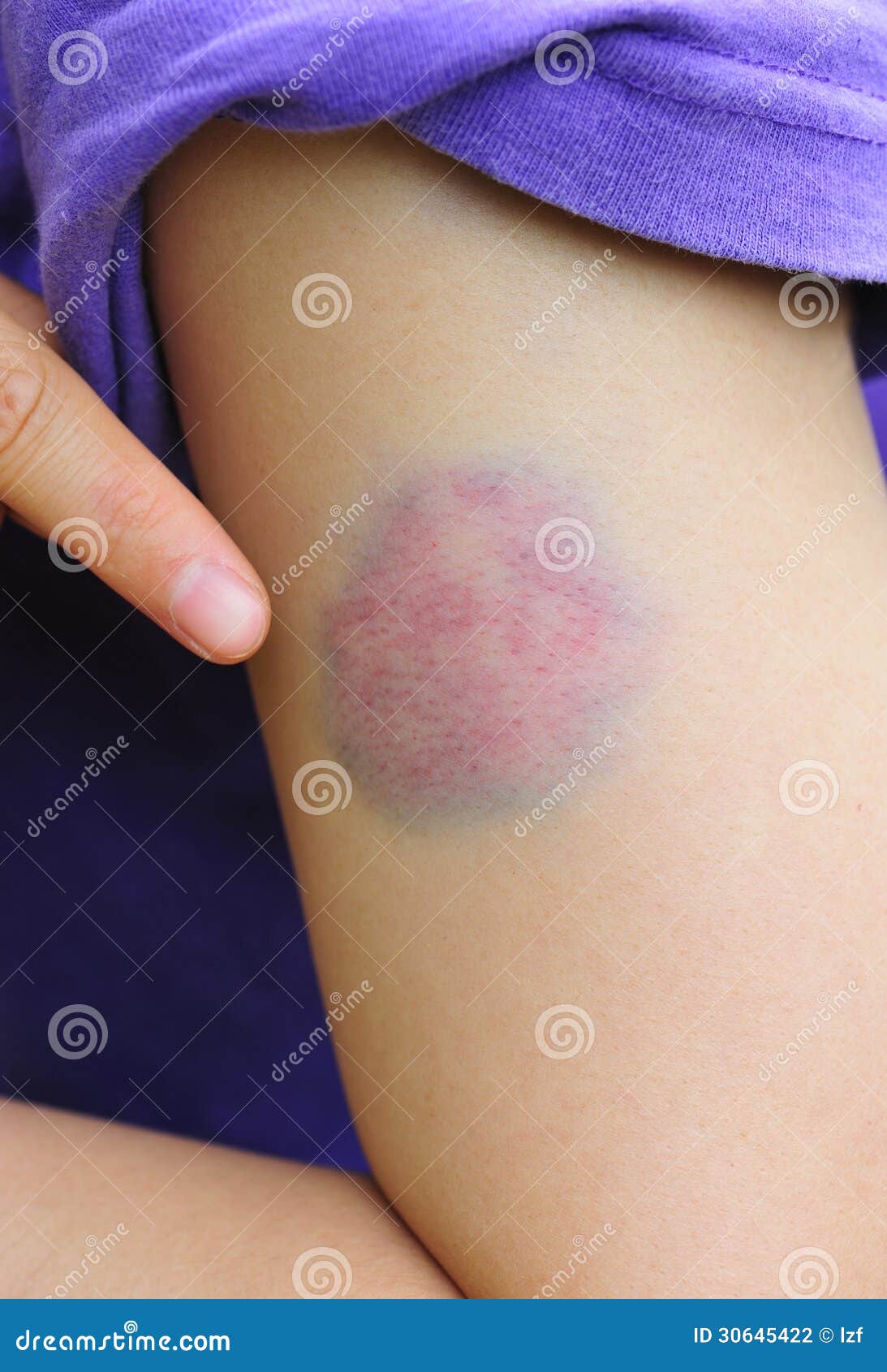 Domestic violence stock photo. Image of health, female - 30645422