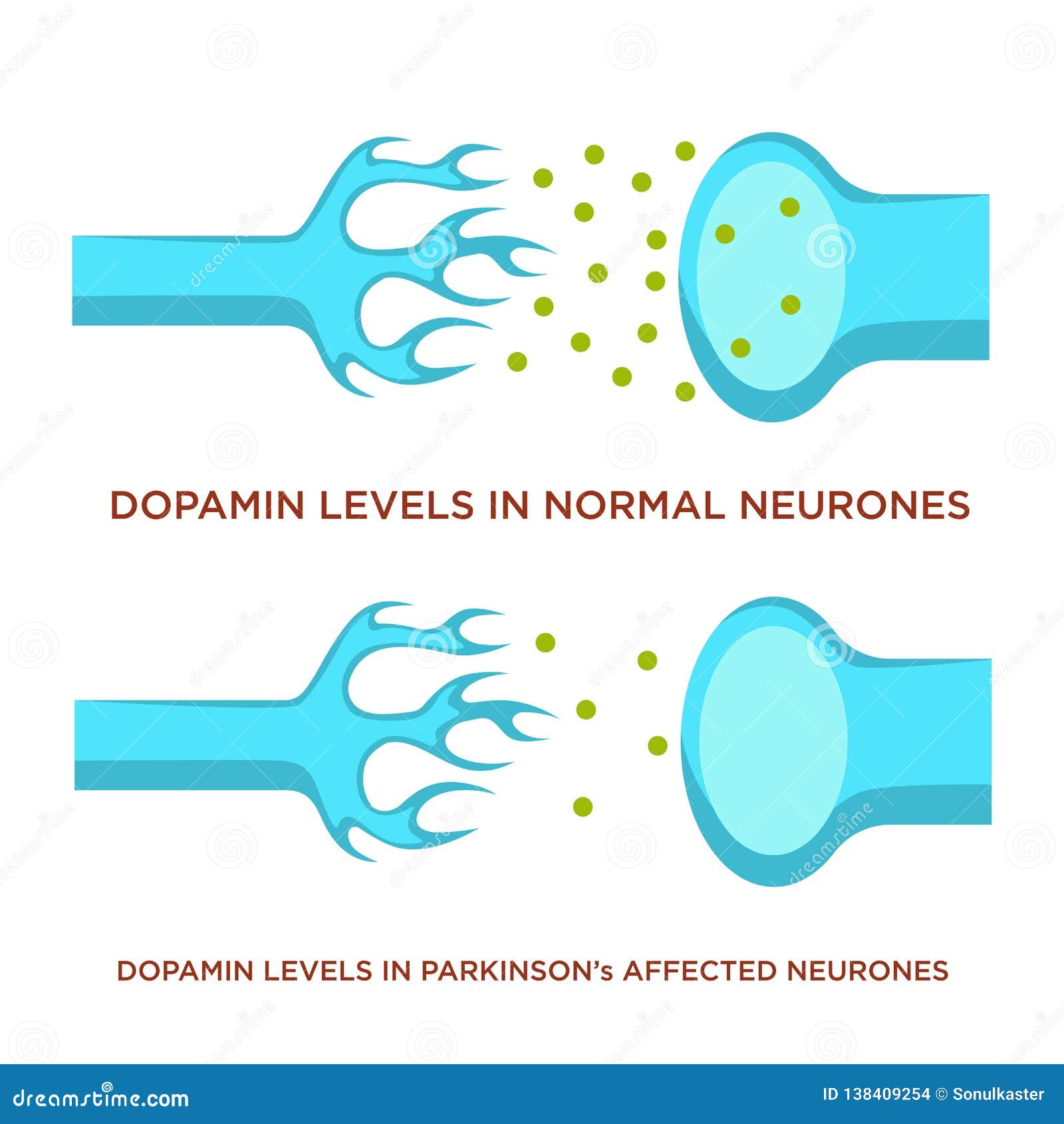 Parkinson`s Disease Symptoms And Signs. Vector Illustration ... Parkinson`s Disease Symptoms And Signs. Vector Illustration ...