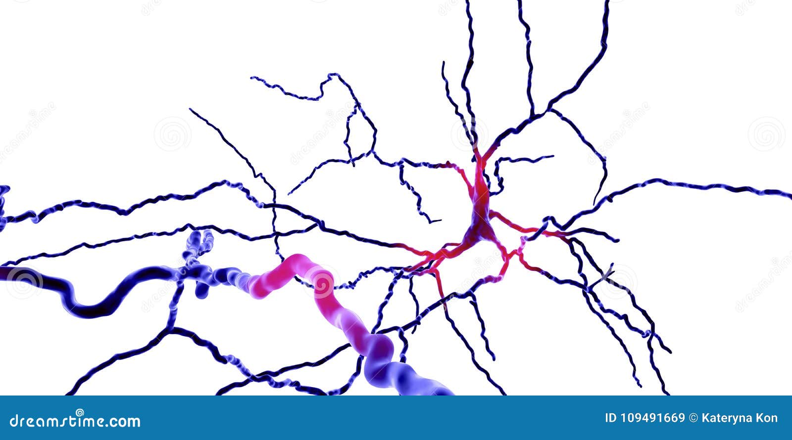 Dopaminergic Neuron. Degeneration of this Brain Cells are Responsible ...