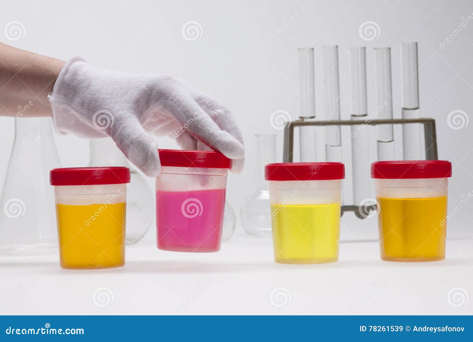 Doping Test of Urine on Laboratory Stock Image - Image of line ...