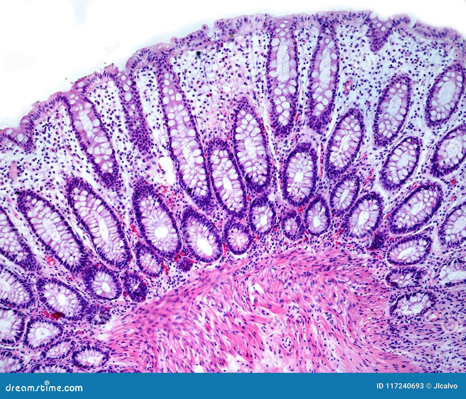 Dos Puntos Humanos Criptas Del Hn Del ¼ De LieberkÃ Imagen de archivo ...