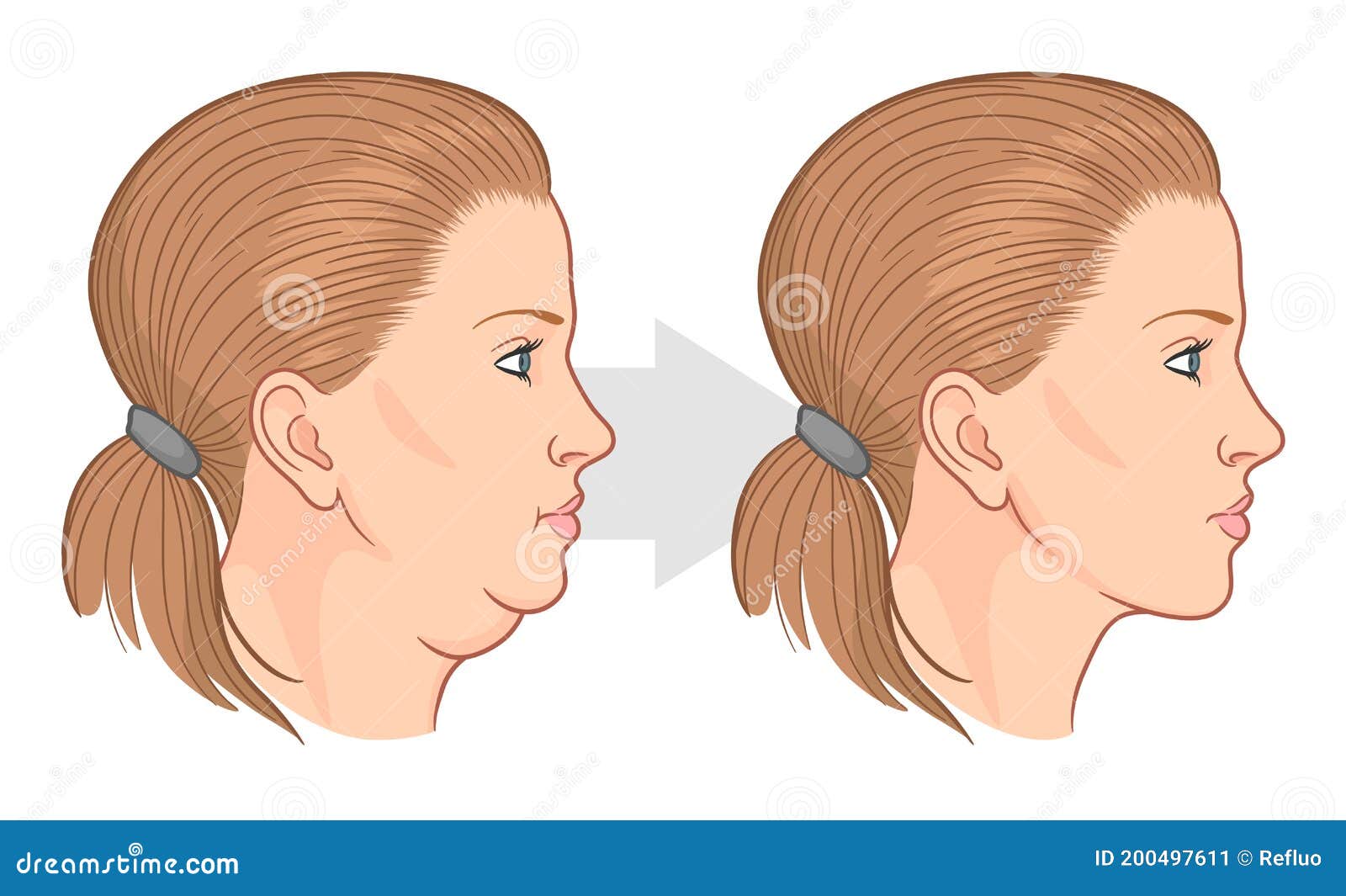Chin Double Stock Illustrations – 242 Chin Double Stock Illustrations ...