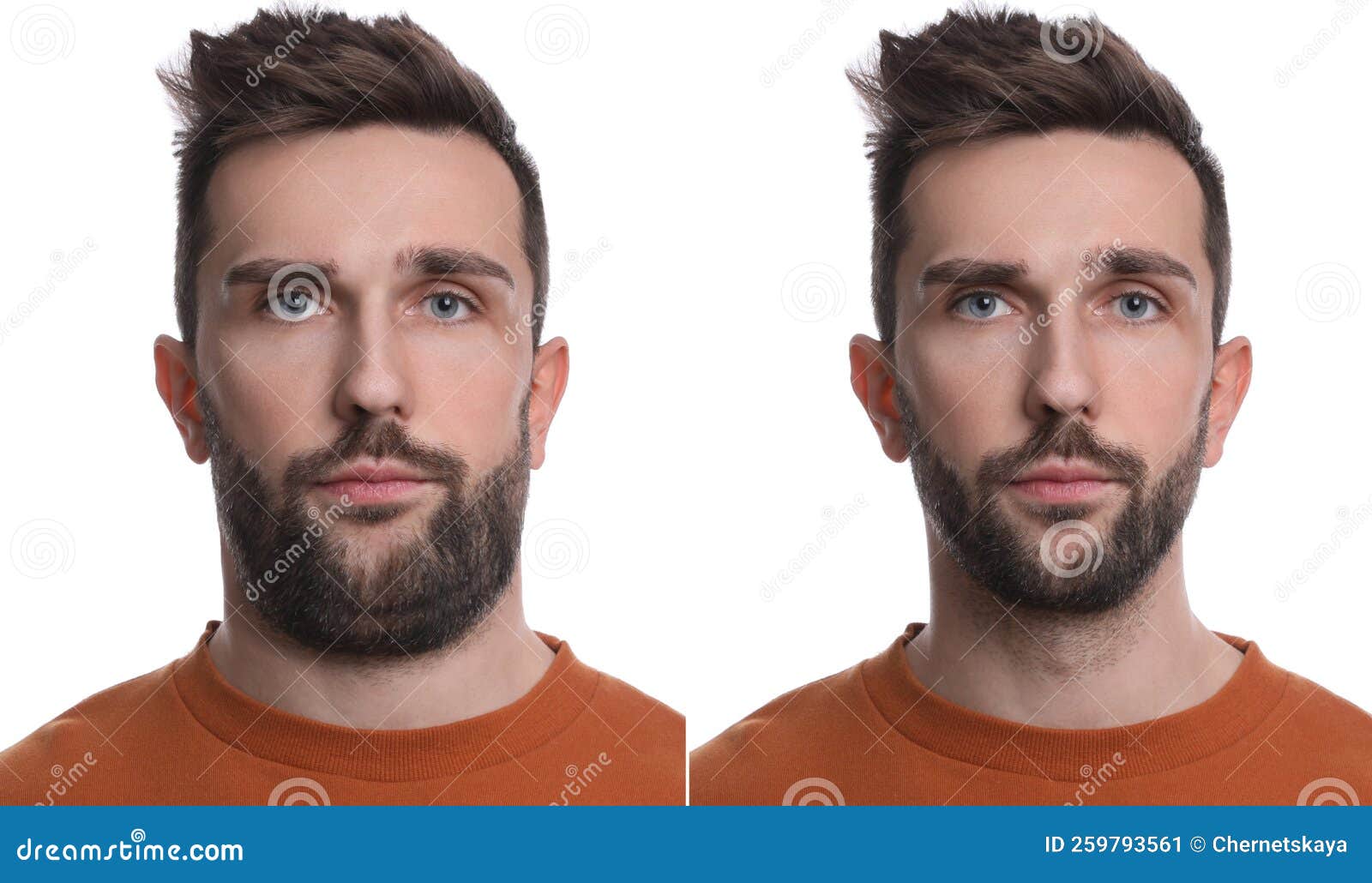 Double Chin Problem. Collage with Photos of Man before and after ...