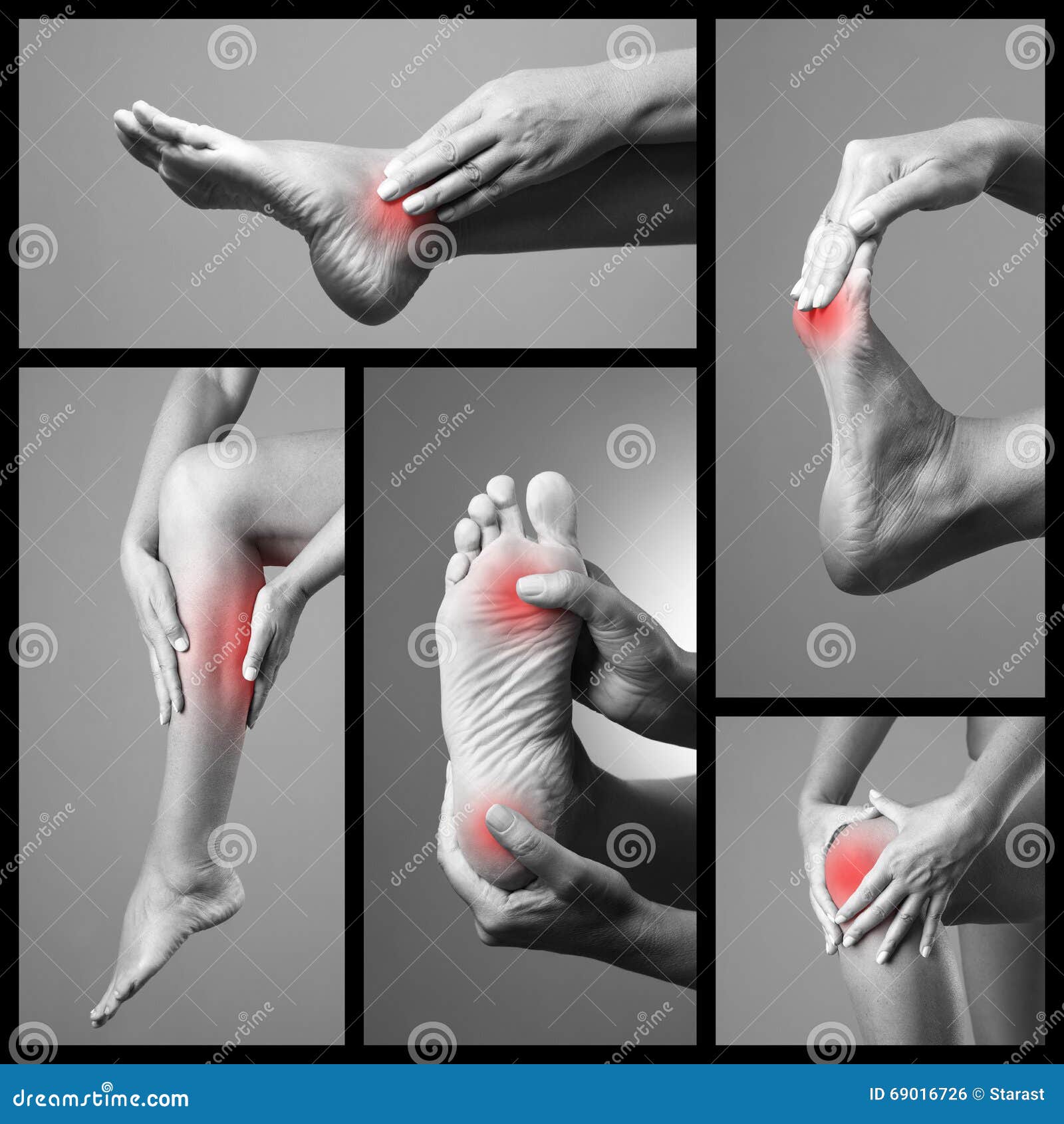 Douleur Dans Le Pied Massage Des Pieds Femelles Blessure Sur Des Jambes