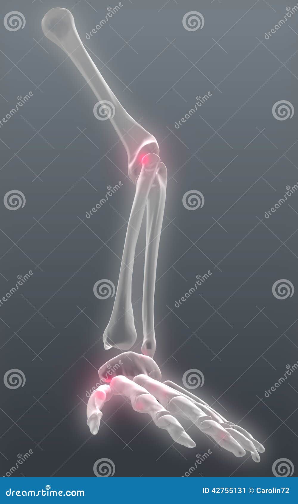 Douleur rhumatismale illustration stock. Illustration du stylisé - 42755131