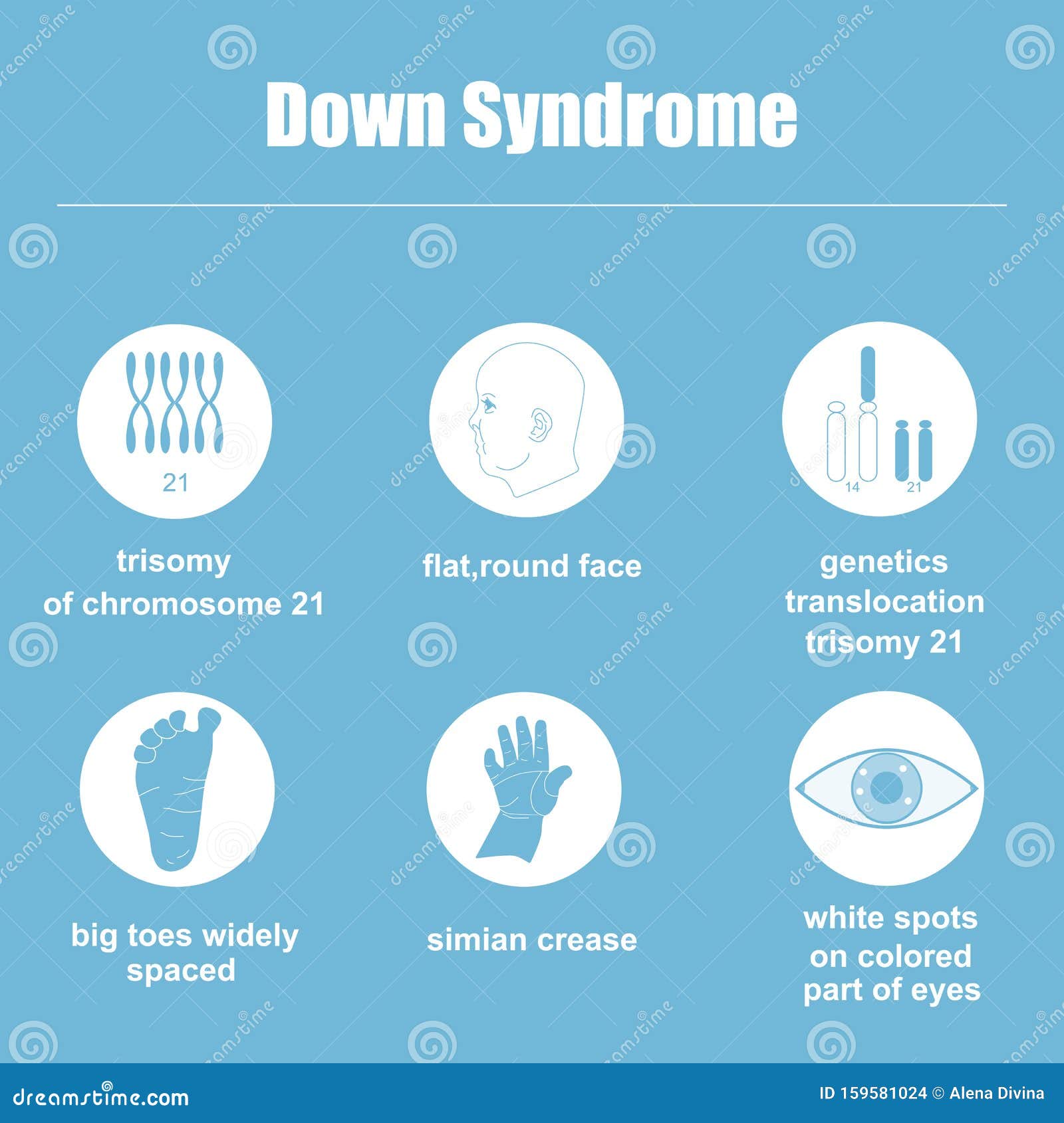 Down Syndrome icons stock vector. Illustration of equality - 159581024