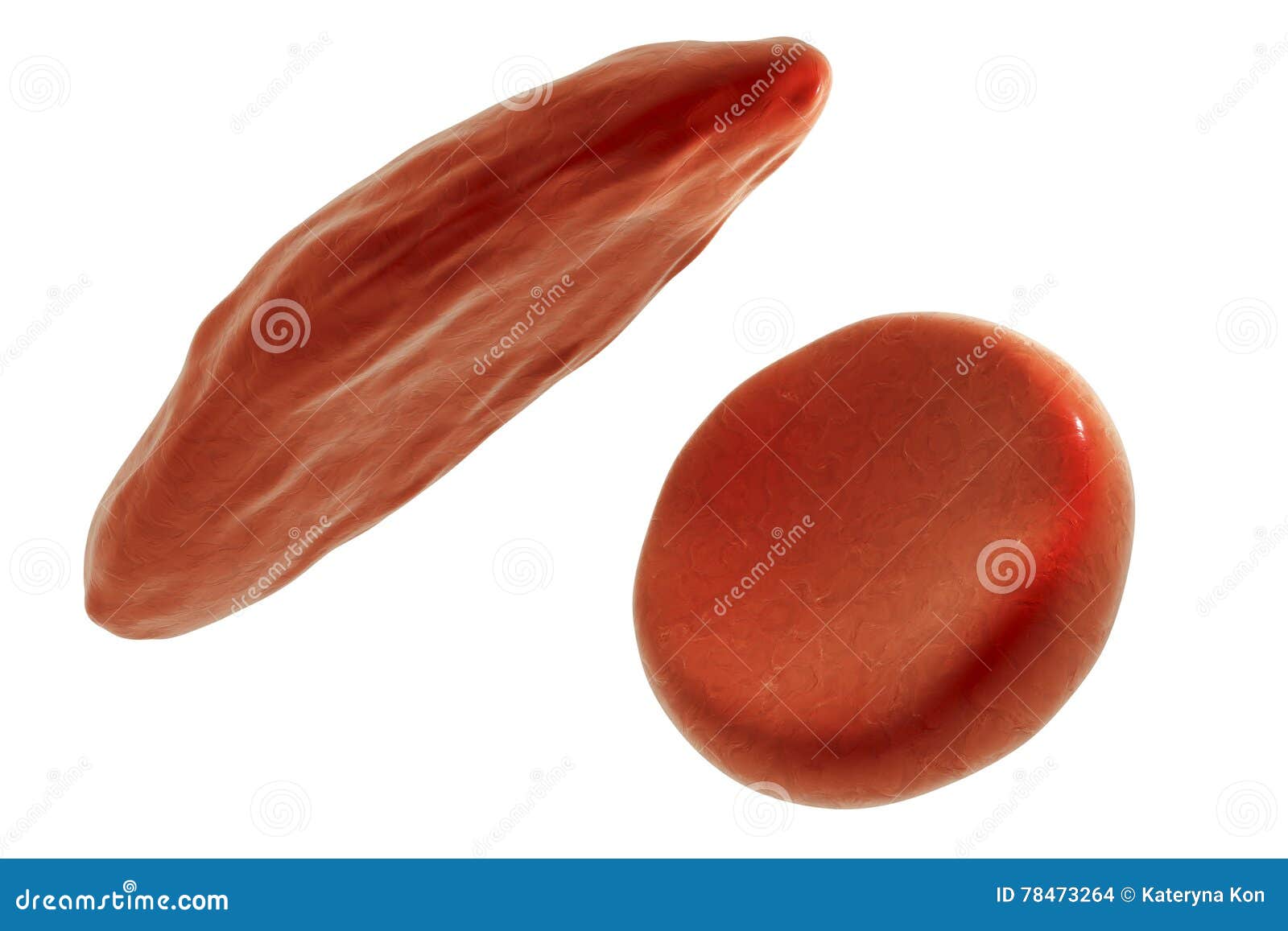Drépanocyte Et Globules Rouges Normales Illustration Stock ...