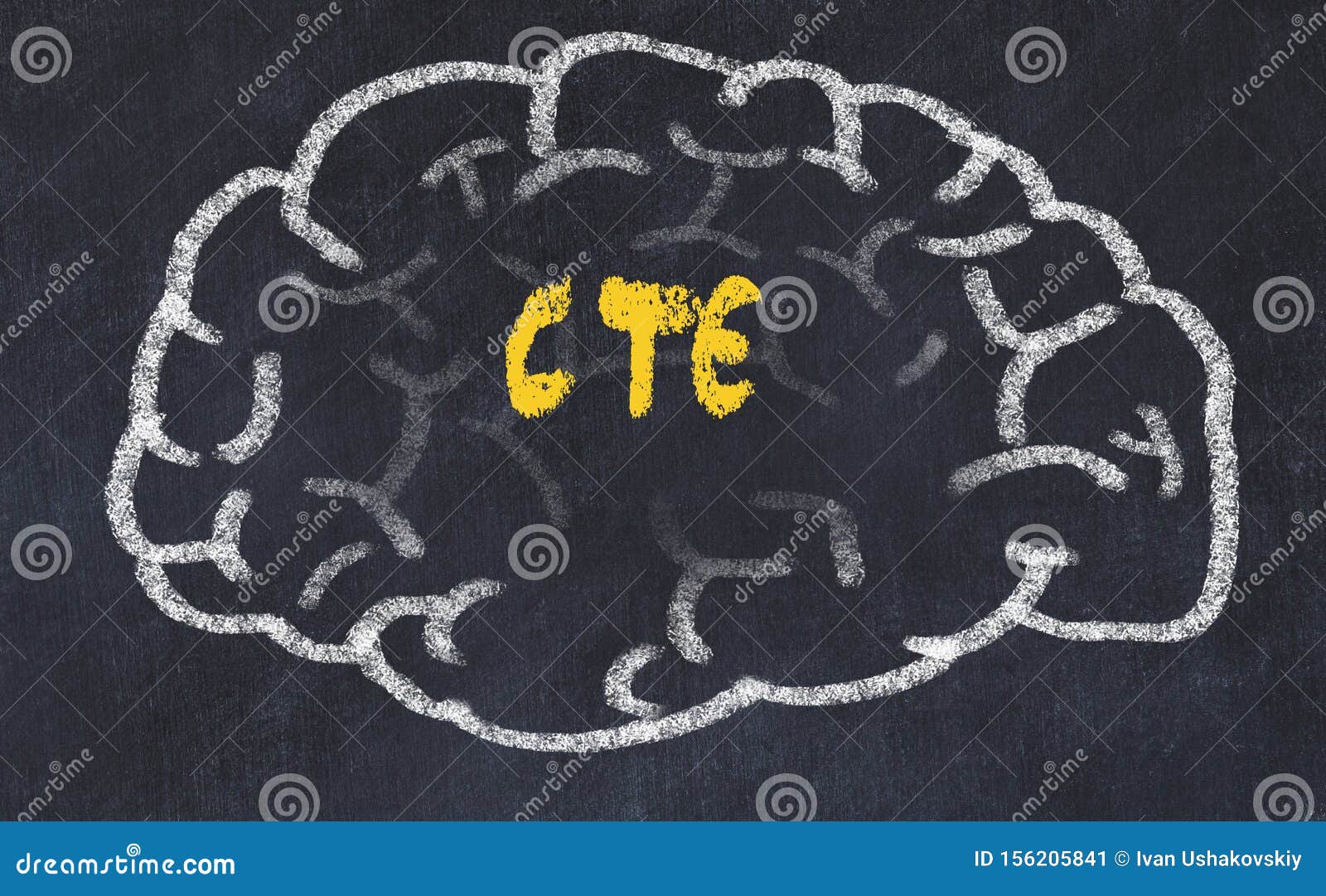 Drawind of Human Brain on Chalkboard with Inscription CTE Stock ...