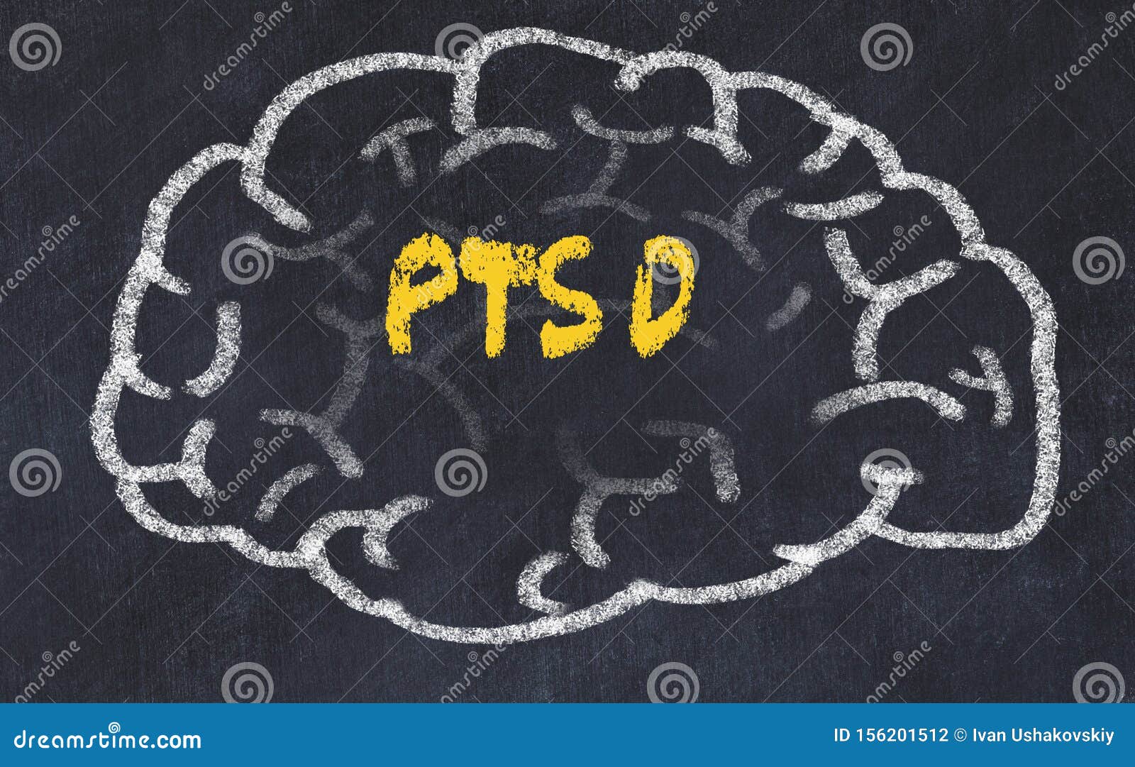 Drawind Of Human Brain On Chalkboard With Inscription PTSD Stock Photo ...