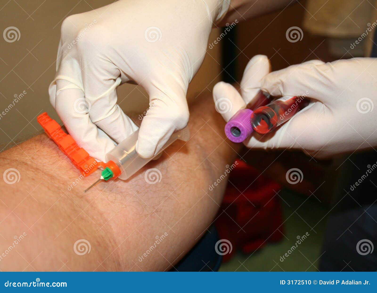 Drawing Blood stock photo. Image of phlebotomy, clinic - 3172510