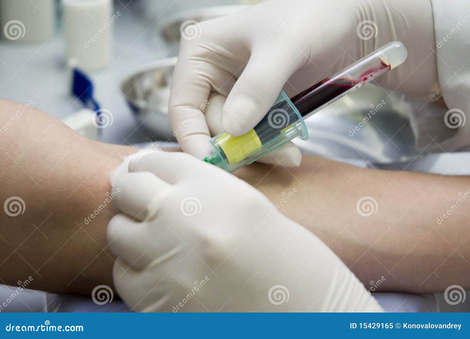 Drawing Blood from Patient in Vitro Diagnostics Stock Image - Image of ...