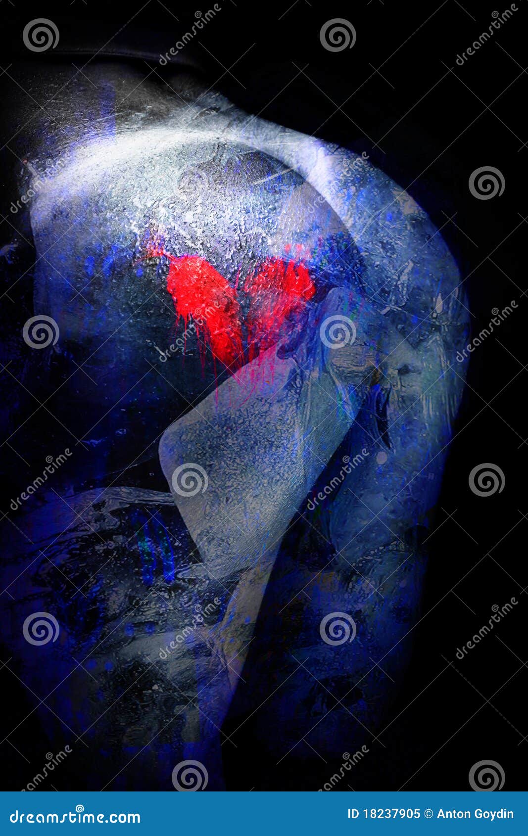 Female Buttocks With Orange Peel Texture. Royalty-Free Stock ...