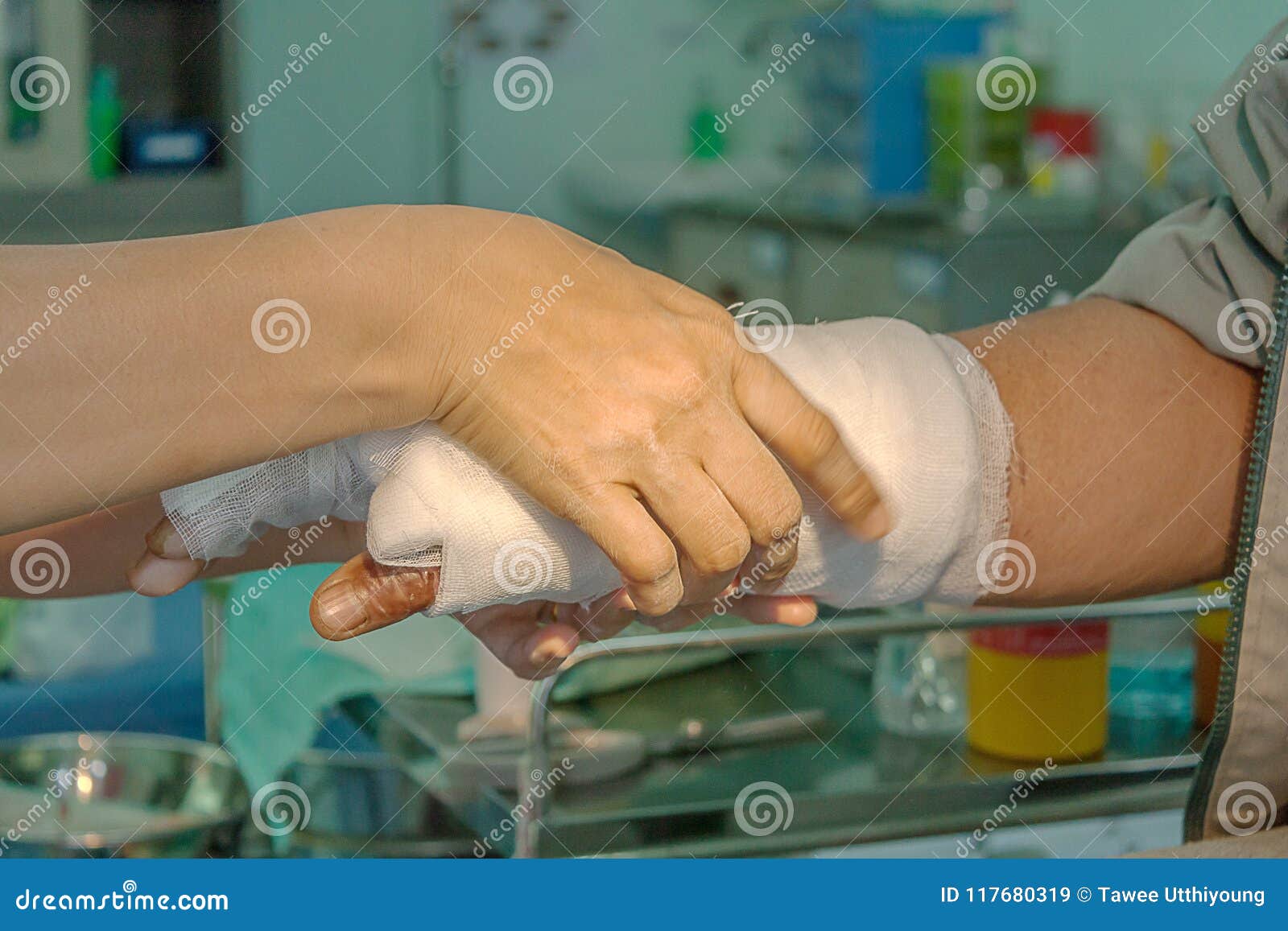 Dressing burned wound stock image. Image of person, burn - 117680319