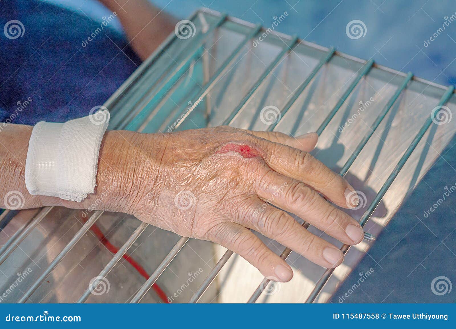 Dressing hand wound stock photo. Image of patient, nurse - 115487558