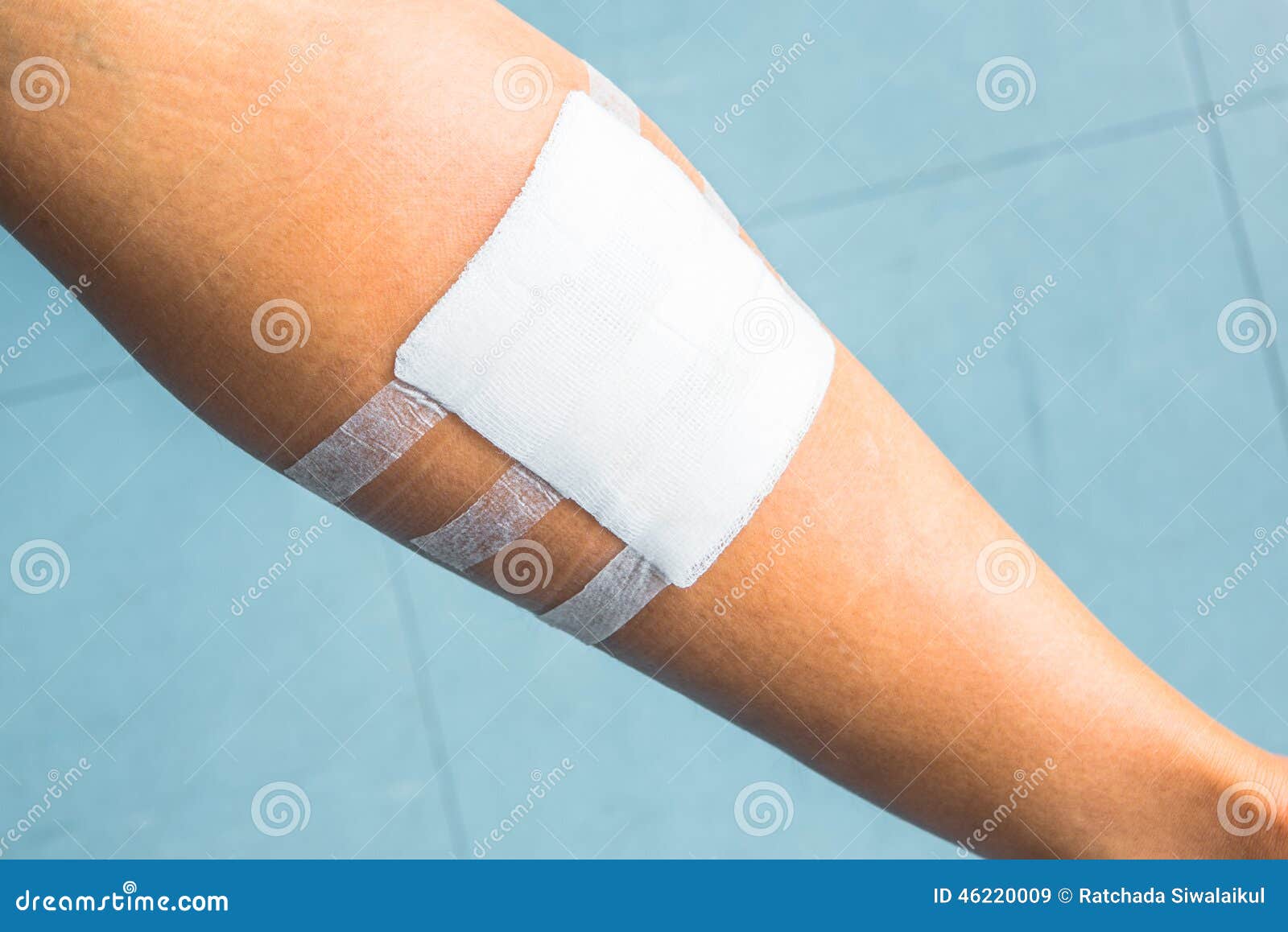 Dressing on leg stock image. Image of mesh, bandage, nurse - 46220009