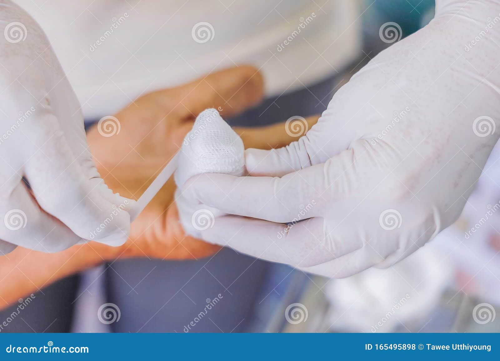 Finger infected wound stock photo. Image of care, injury - 165495898