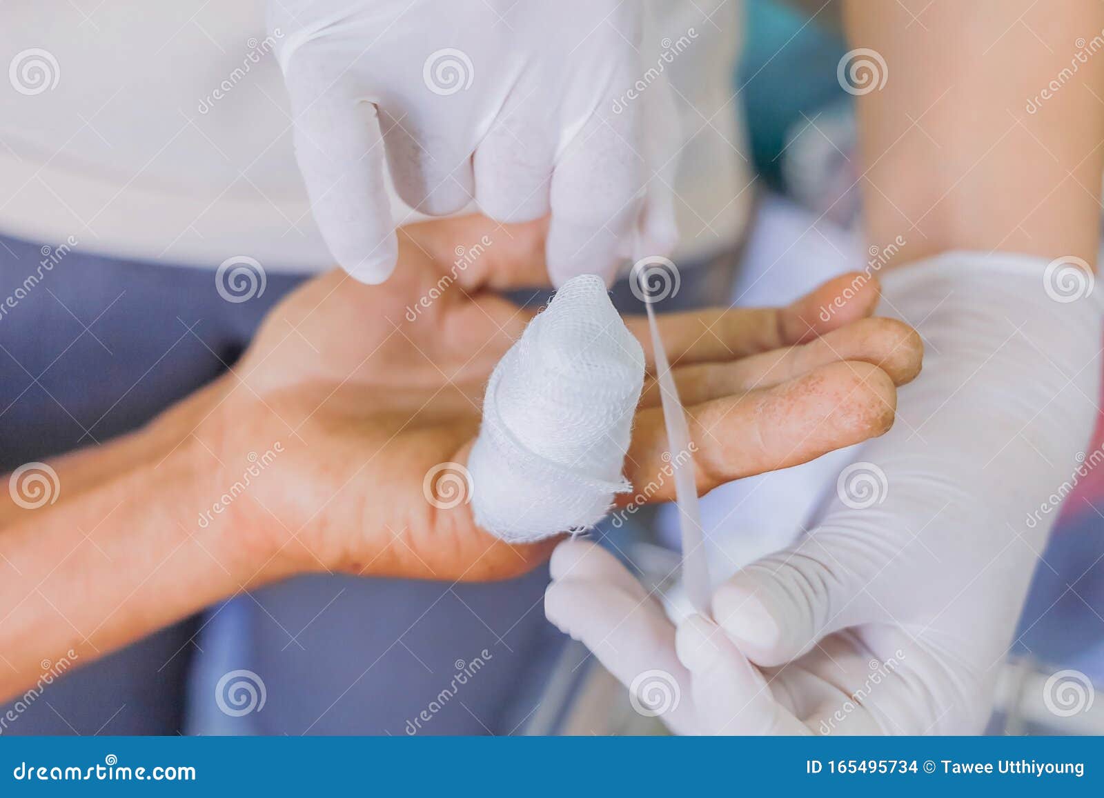 Finger infected wound stock photo. Image of human, disease - 165495734