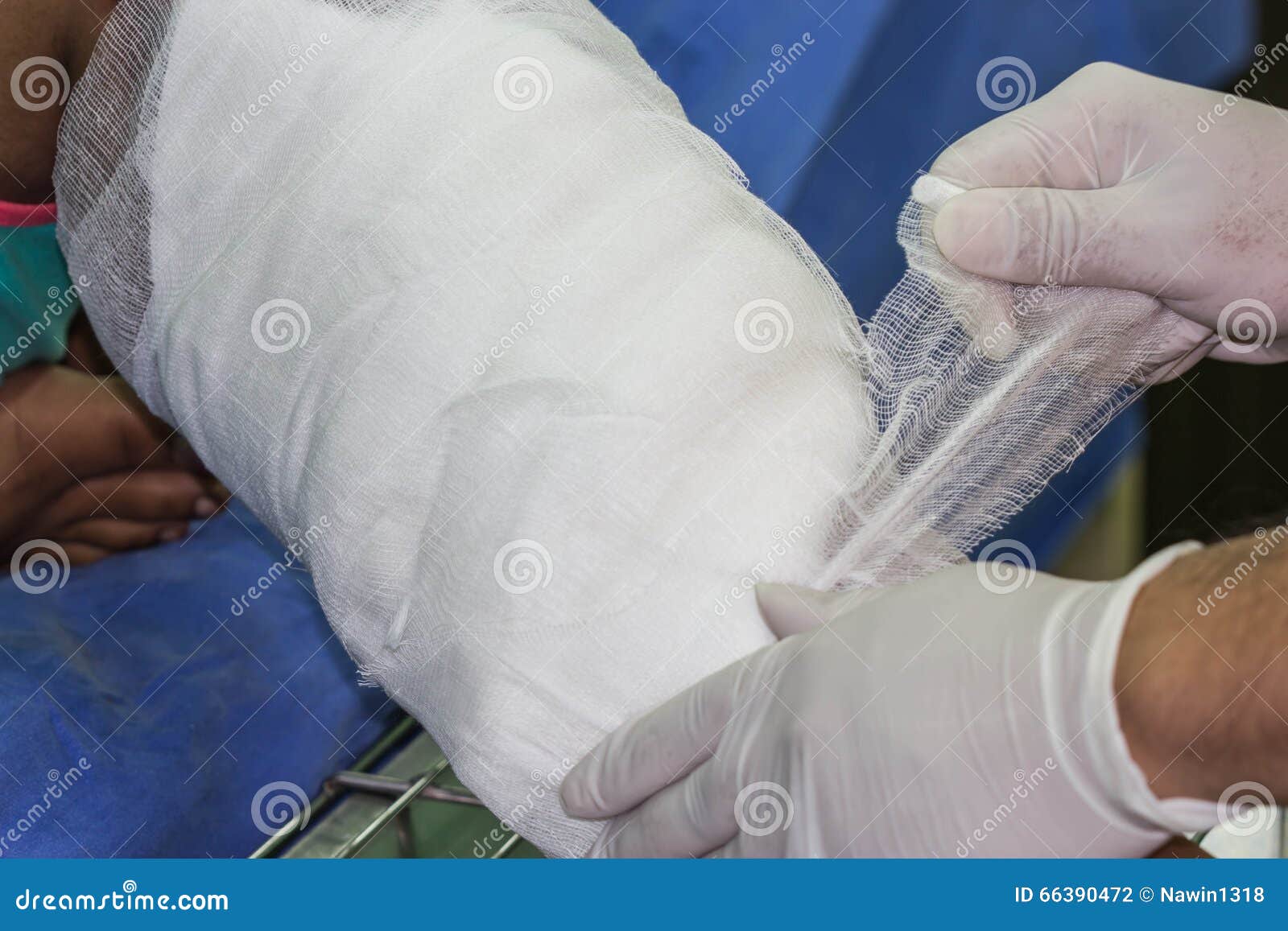 Dressing Patient S Wound with Bandage Stock Photo - Image of cast, lady ...