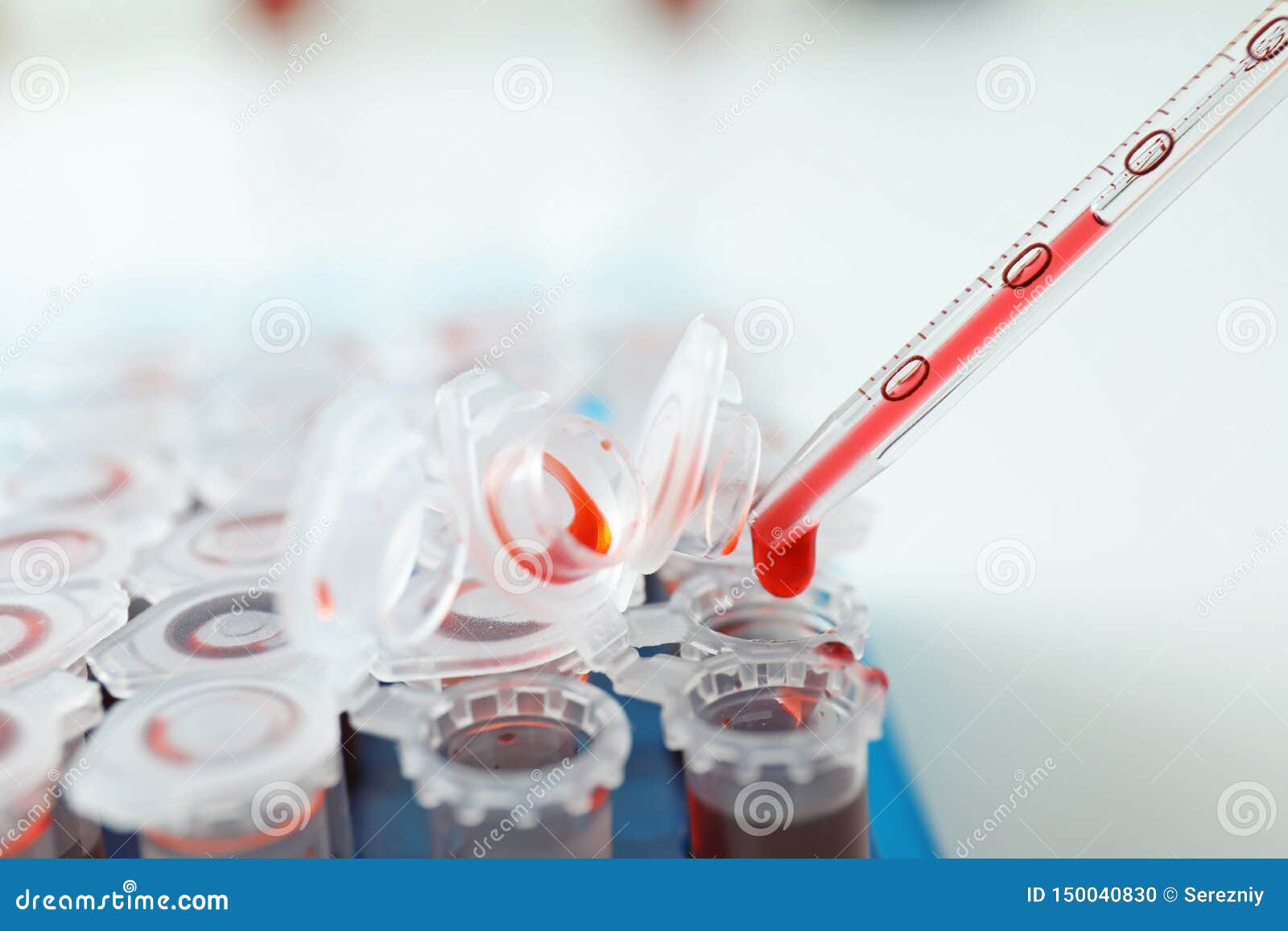 Dripping Blood Samples into Test Tubes, Closeup Stock Photo - Image of ...
