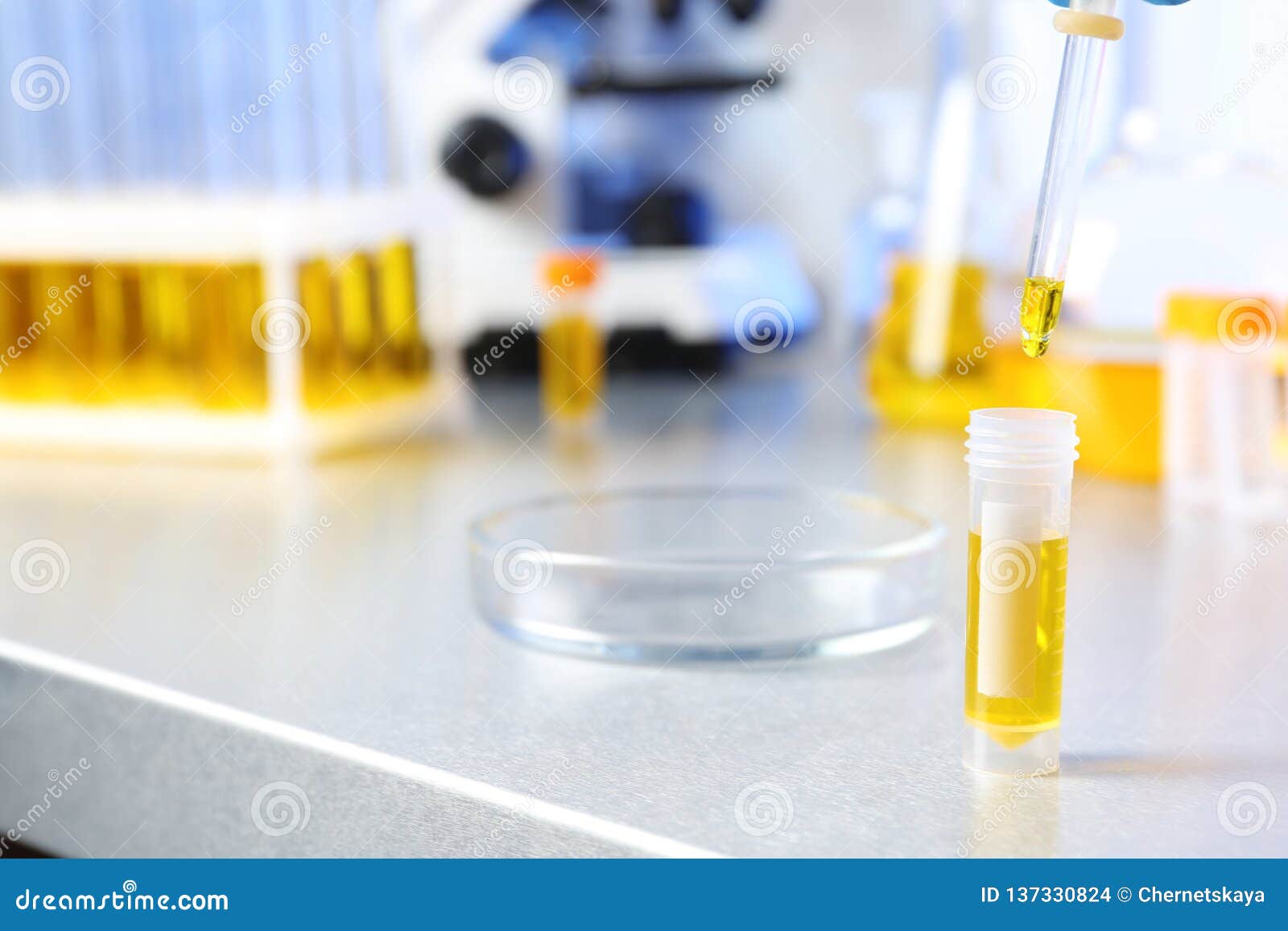 Dripping Urine Sample from Pipette into Container on Table in ...