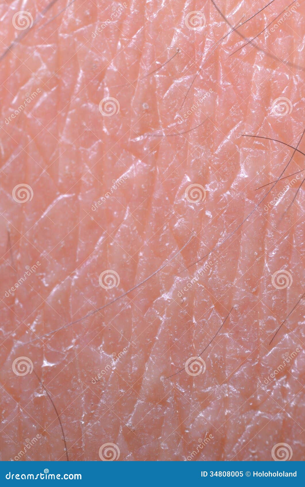 Droge huid stock afbeelding. Image of vlek, teint, menselijk - 34808005