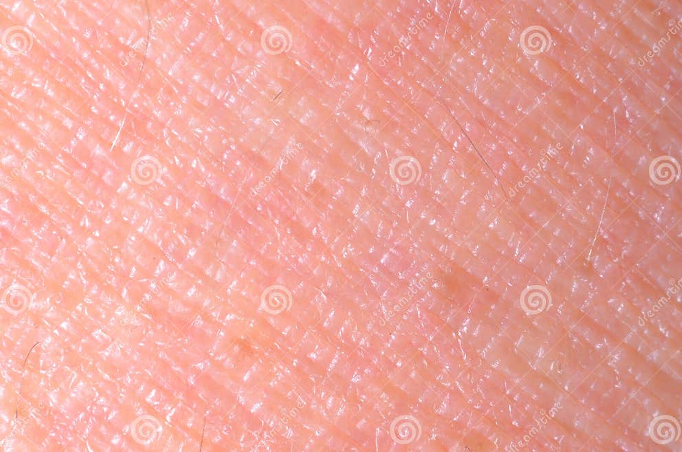 Droge huid stock foto. Image of loods, huid, ziekenhuis - 34808310