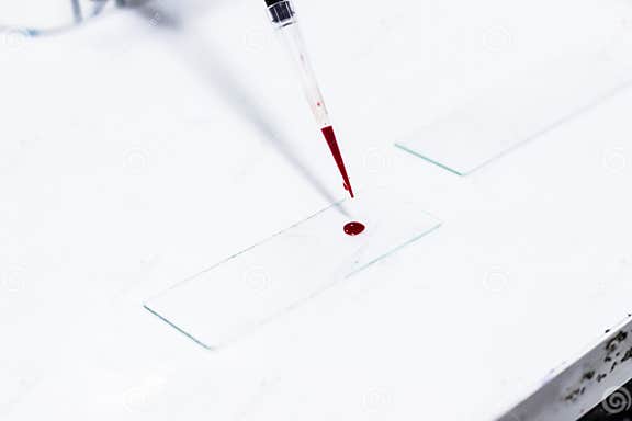 Drop of Blood on a Glass Slide Using Micropipette Microtip Stock Image ...