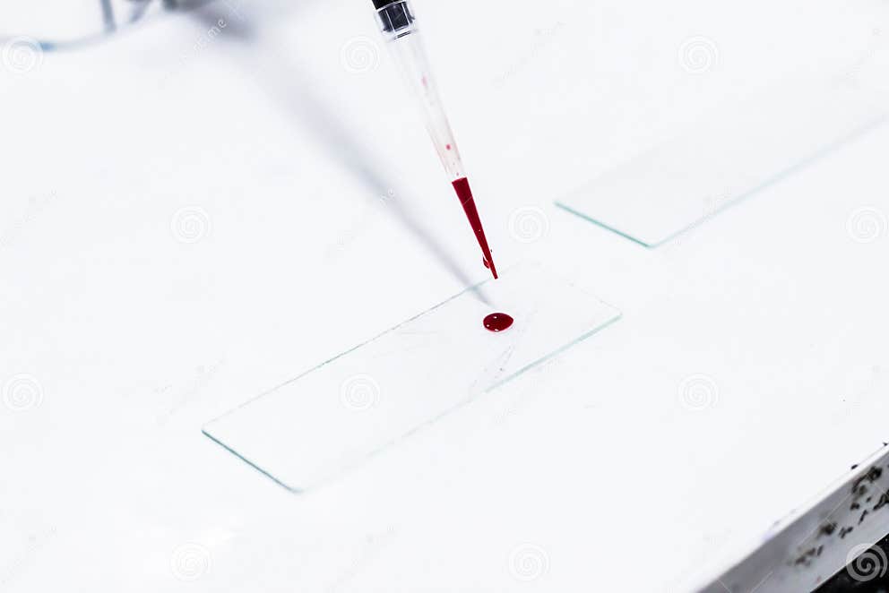Drop of Blood on a Glass Slide Using Micropipette Microtip Stock Image ...