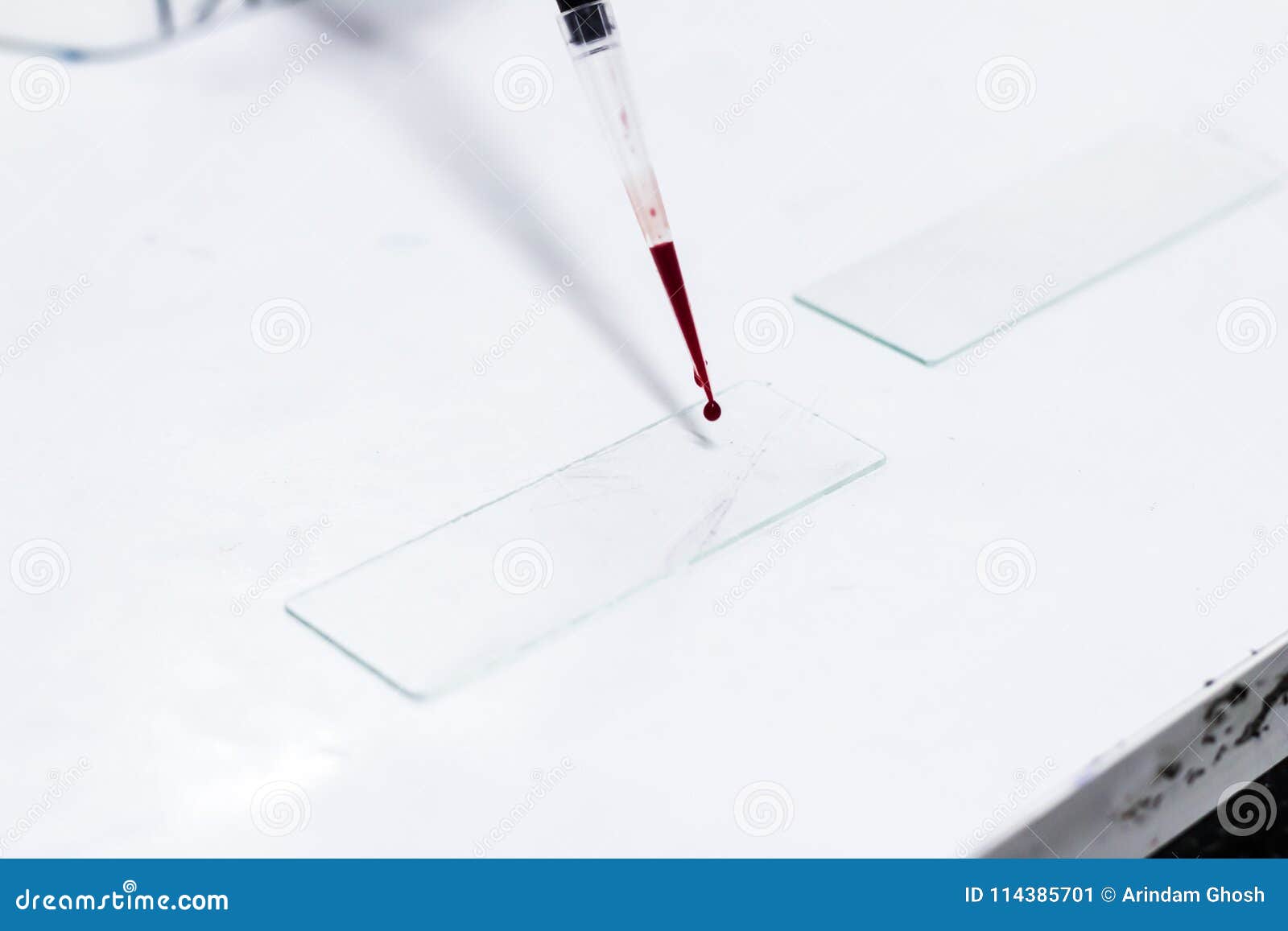 Drop of Blood on a Glass Slide Using Micropipette Microtip Stock Image ...