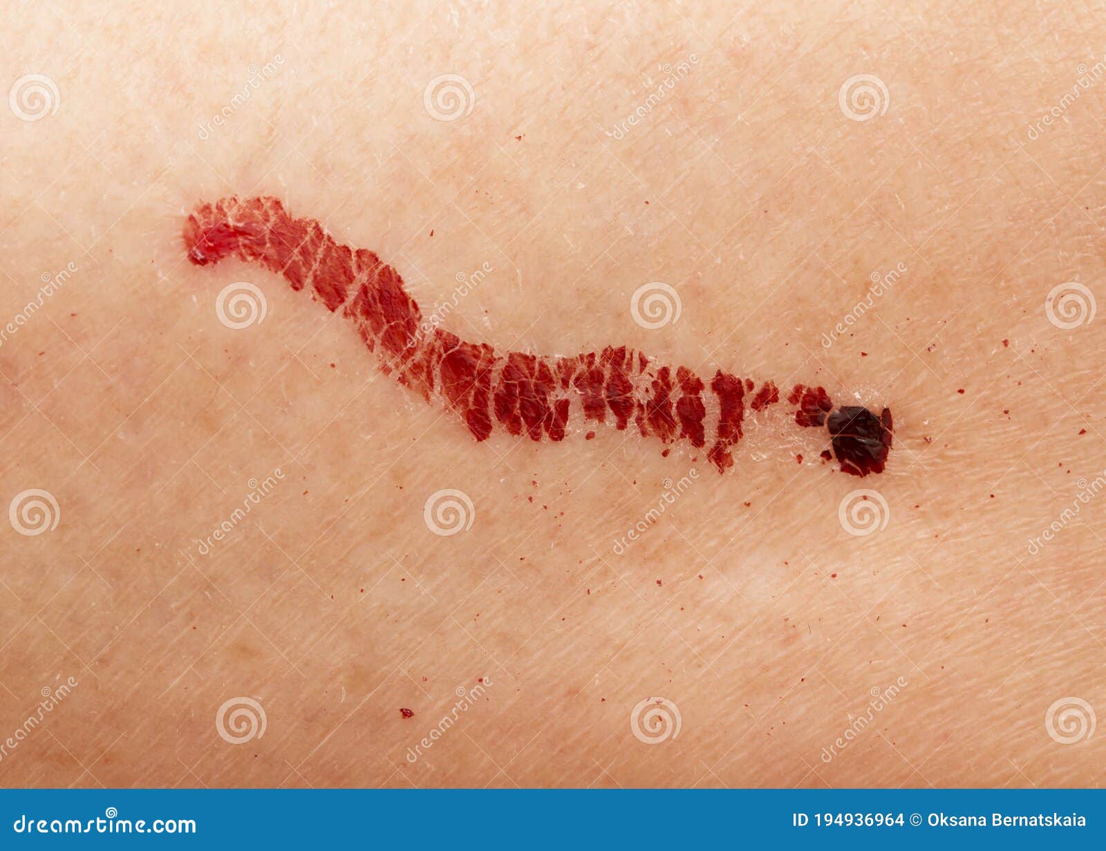A Drop of Blood on the Skin Stock Photo - Image of blood, contrast ...