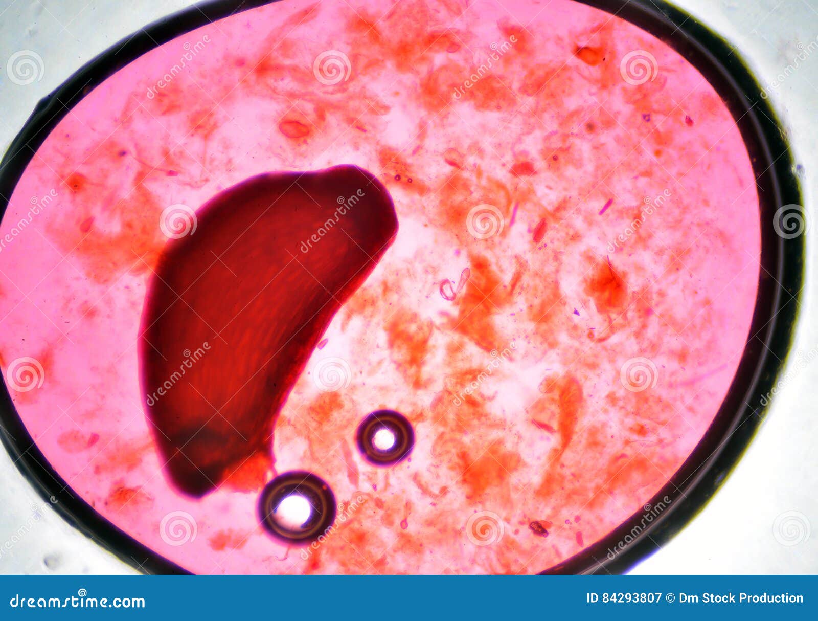 Raspberry Under Microscope Stock Photos - Free & Royalty-Free Stock ...