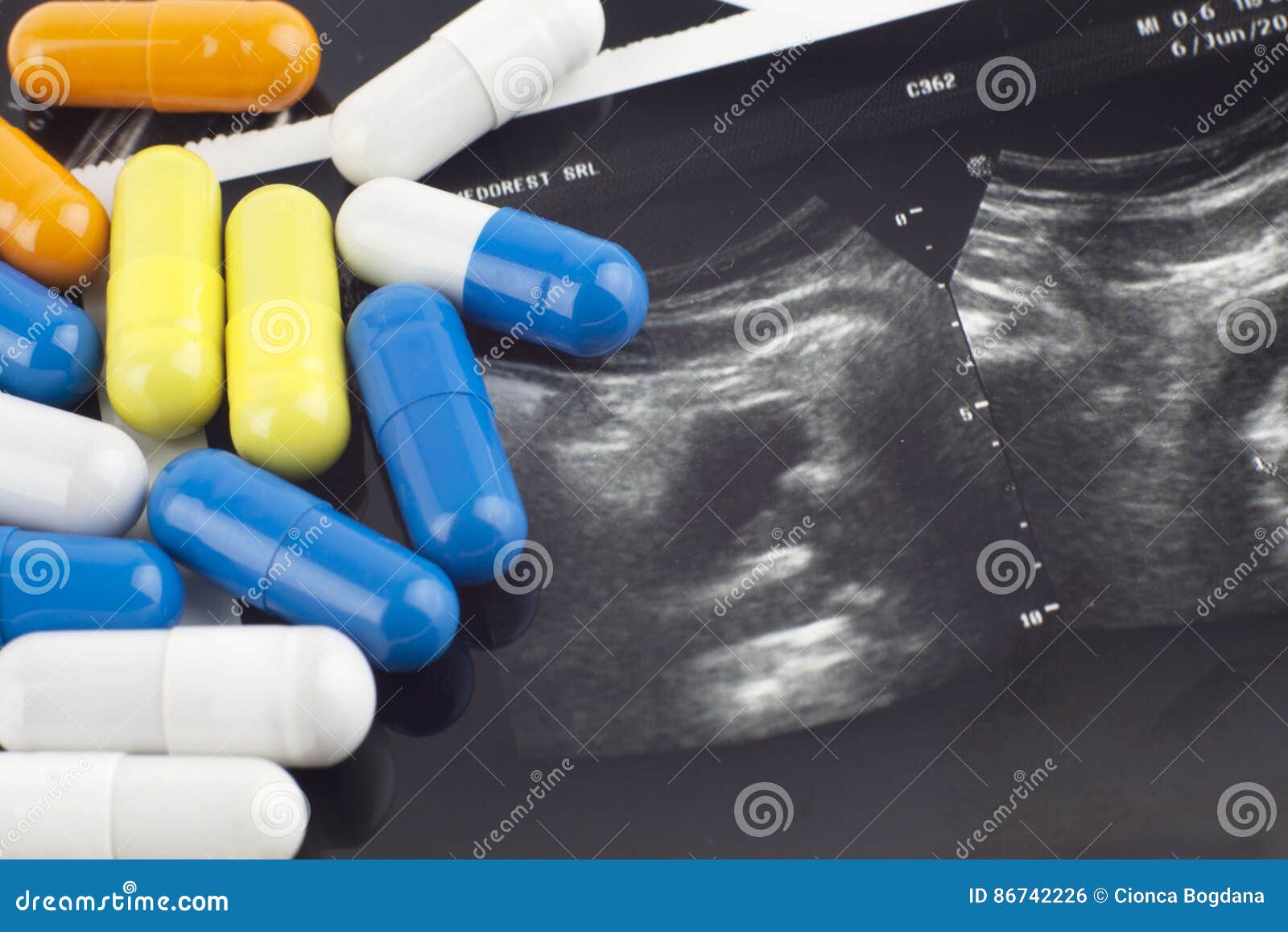 Drugs and Syringe on a Sheet of X-ray Stock Photo - Image of heart ...