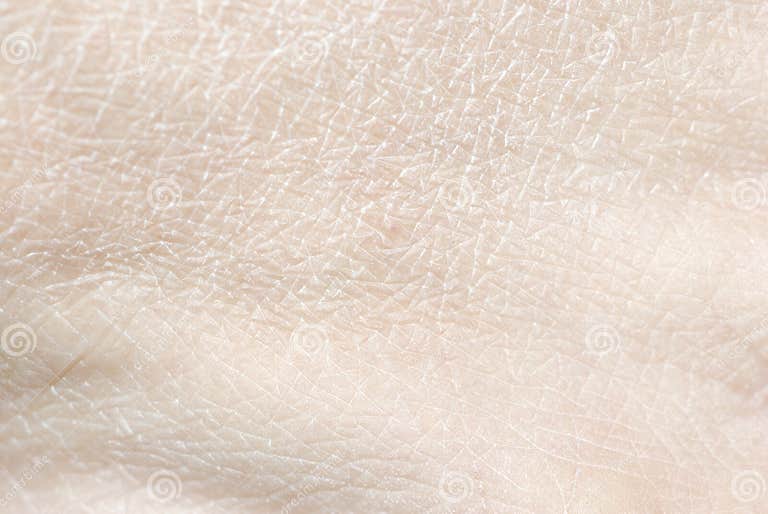 Dry human skin stock photo. Image of head, female, concept - 13389646