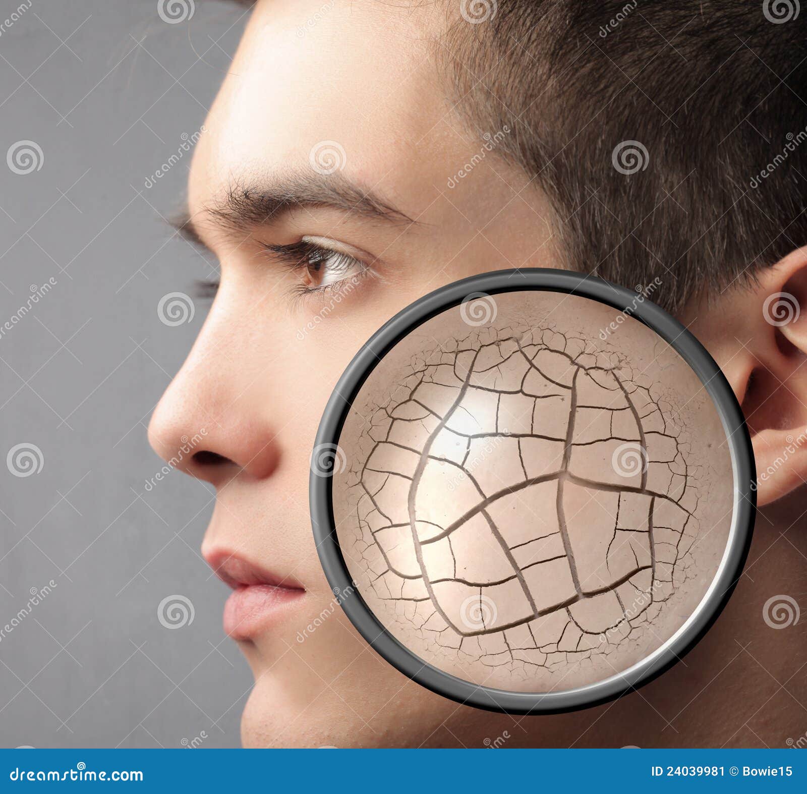 Dry skin stock image. Image of treatment, care, wrinkle - 24039981