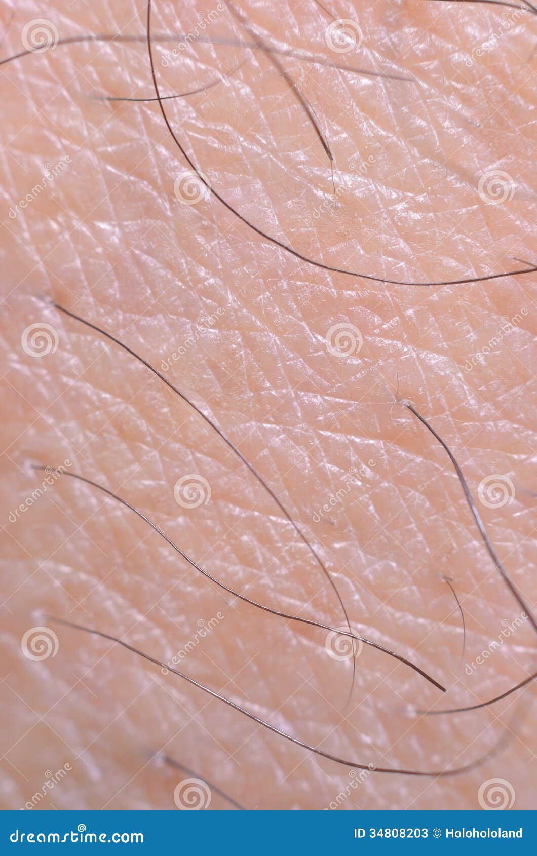 Dry skin stock image. Image of hospital, sick, skin, dermatology - 34808203