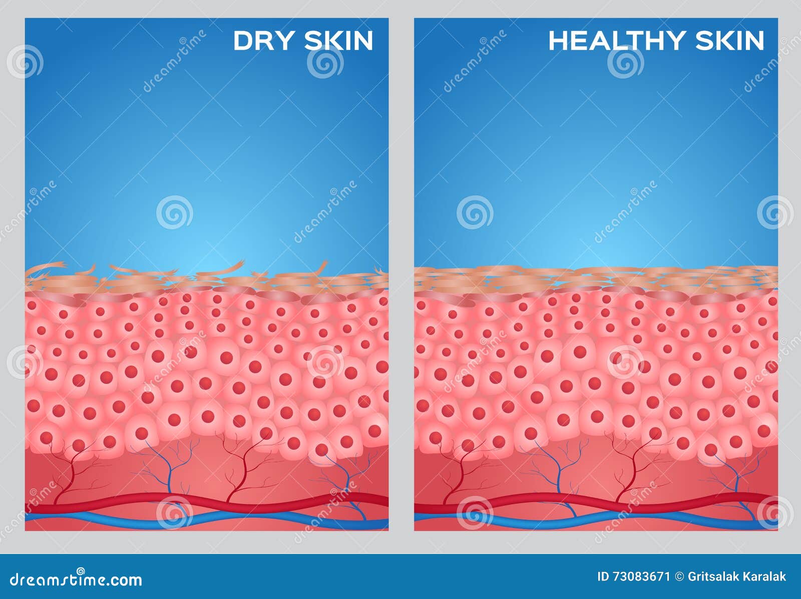 Dry Skin, Healthy Skin Texture , Stock Illustration - Illustration of ...