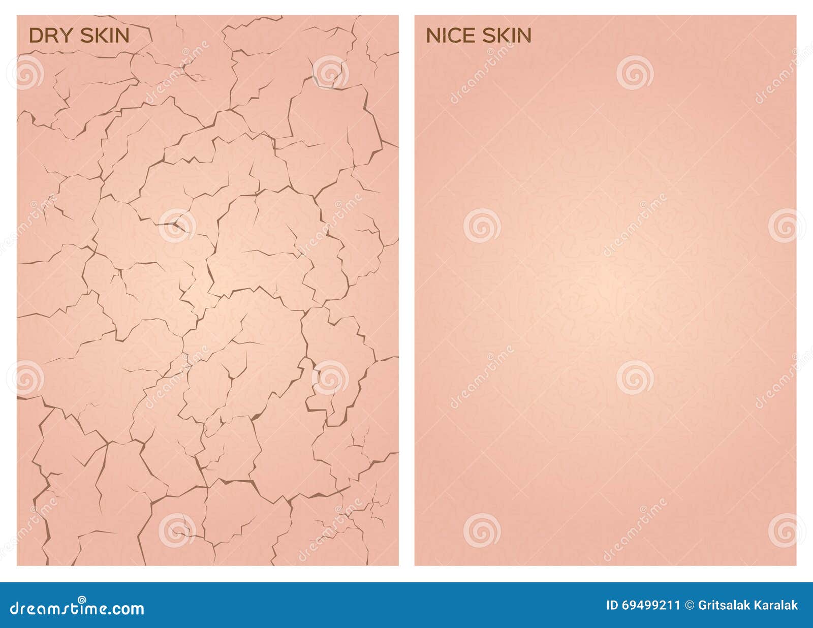 Dry Skin, Nice Skin Texture , Stock Vector - Illustration of problem ...