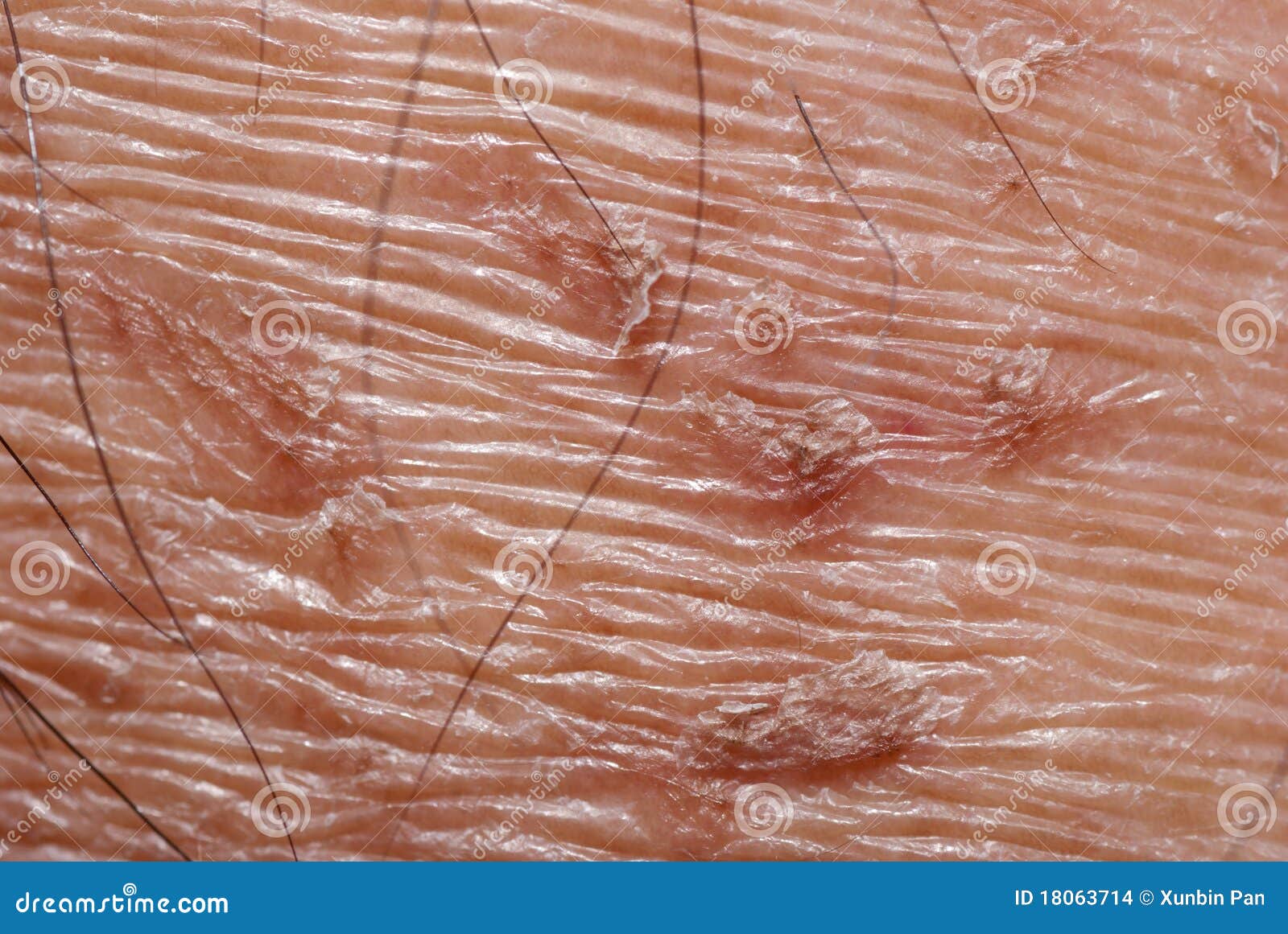 Dry Skin Texture Stock Photo | CartoonDealer.com #18063714