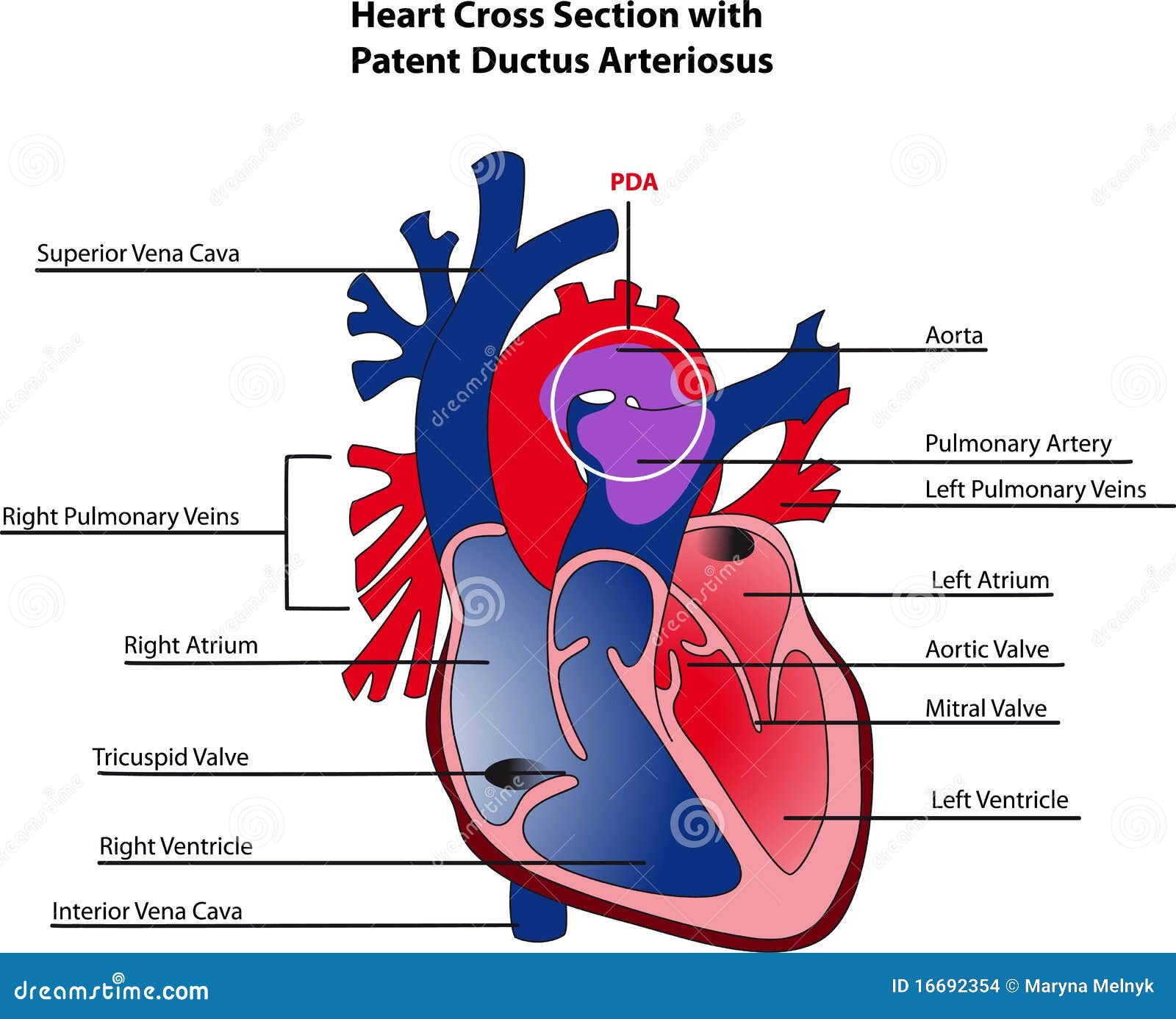 Ductus arteriosus ilustración del vector. Ilustración de heart - 16692354