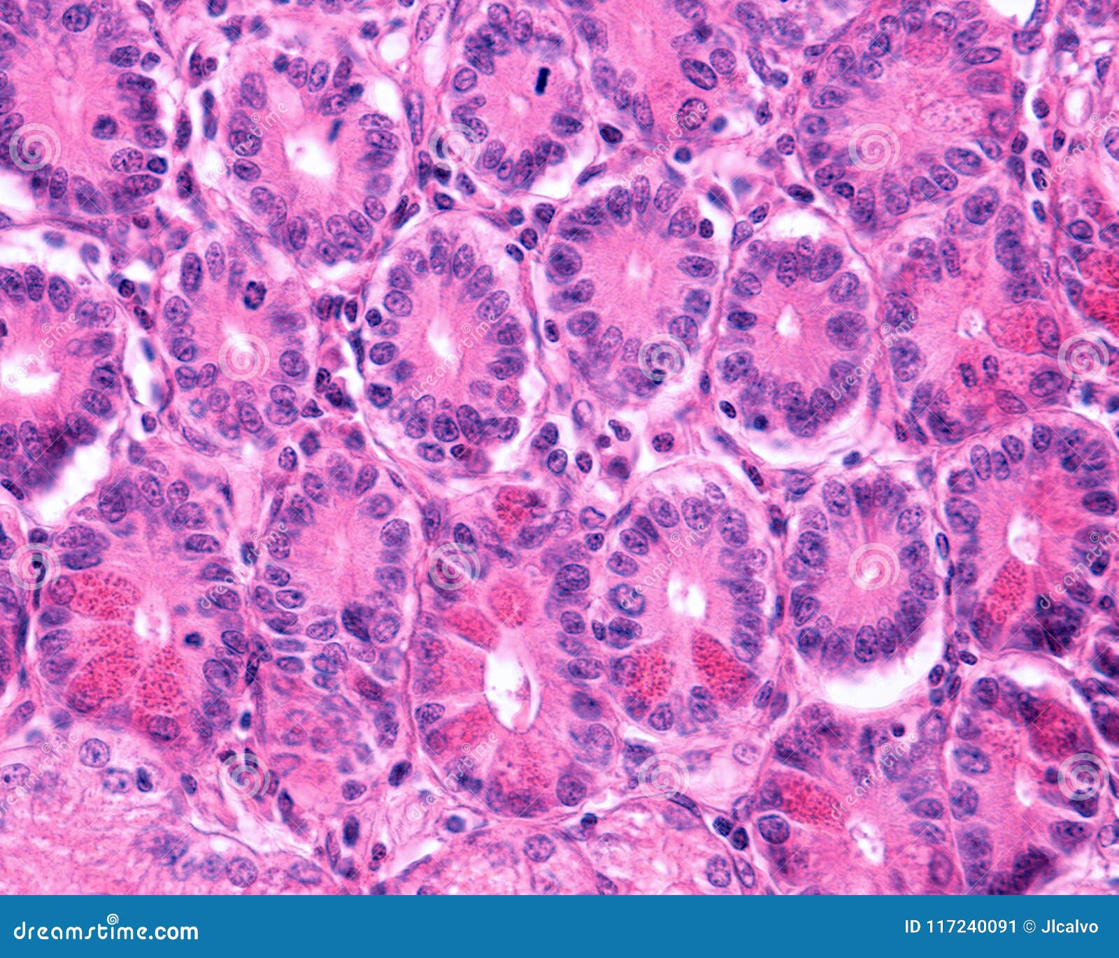 Duodeno Células de Paneth imagen de archivo. Imagen de gastrointestinal ...